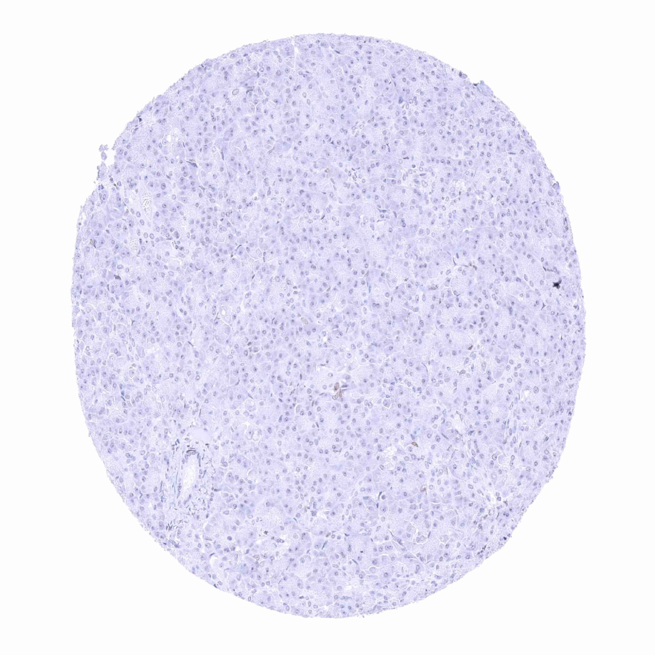 Normal Tissue Gallery TRPS1 - MS Validated Antibodies