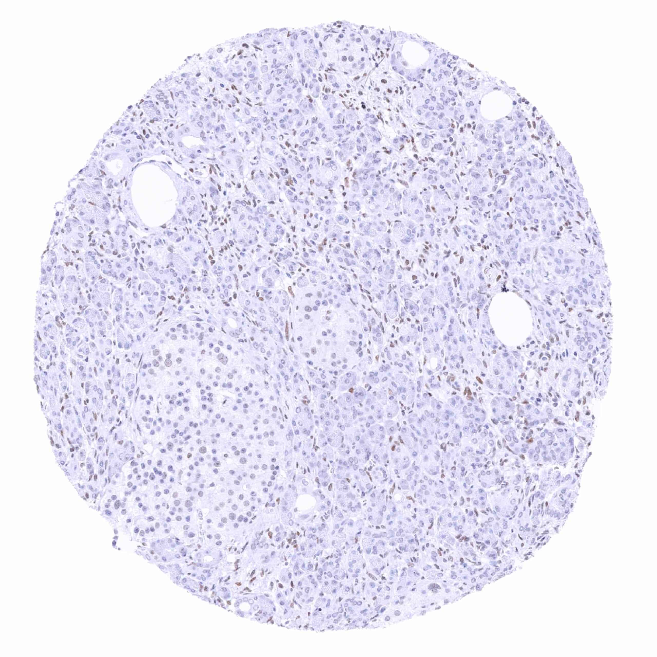 Normal Tissue Gallery TRPS1 - MS Validated Antibodies