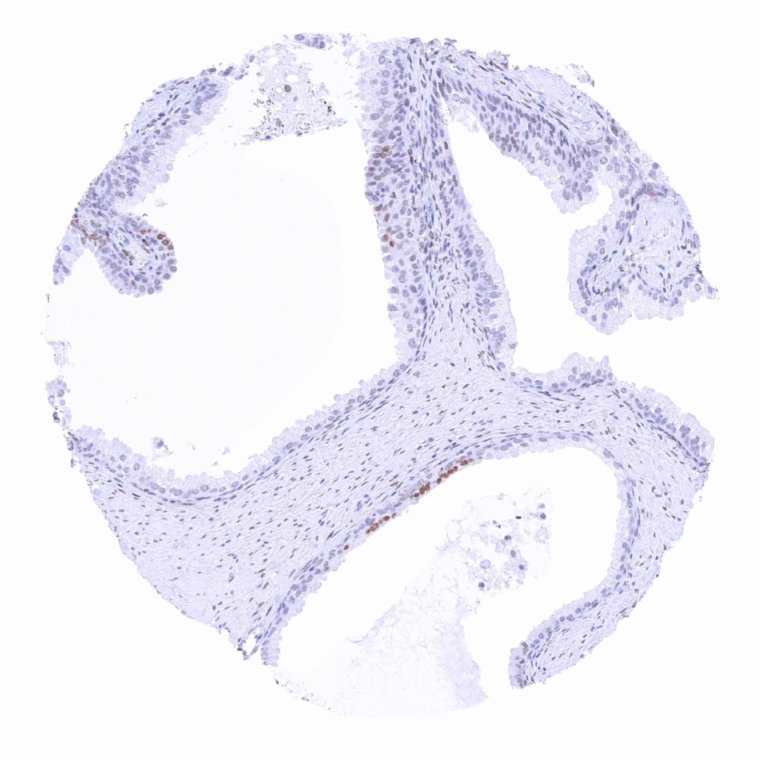 Normal Tissue Gallery TRPS1 - MS Validated Antibodies