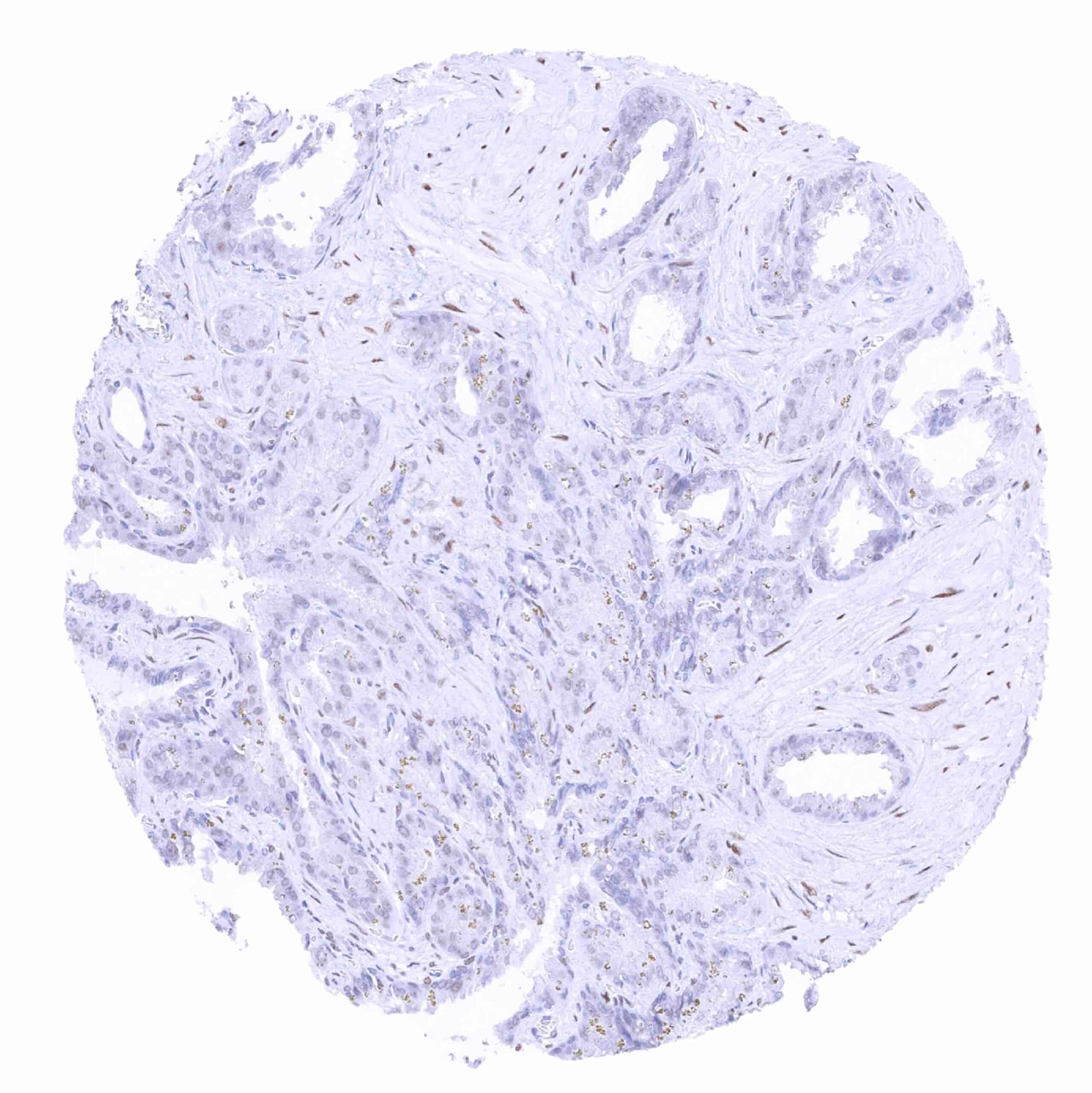 Normal Tissue Gallery TRPS1 - MS Validated Antibodies