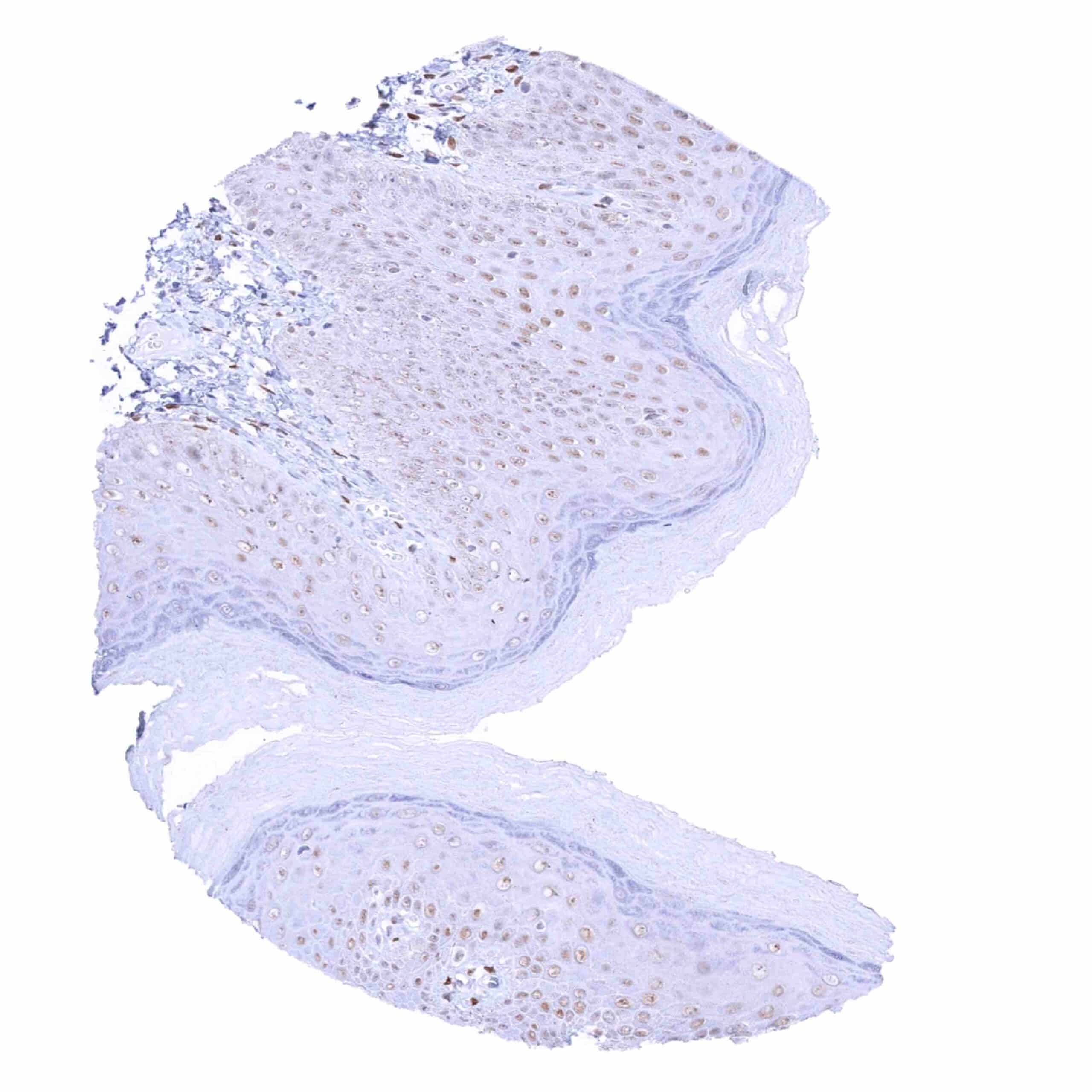 Normal Tissue Gallery TRPS1 - MS Validated Antibodies