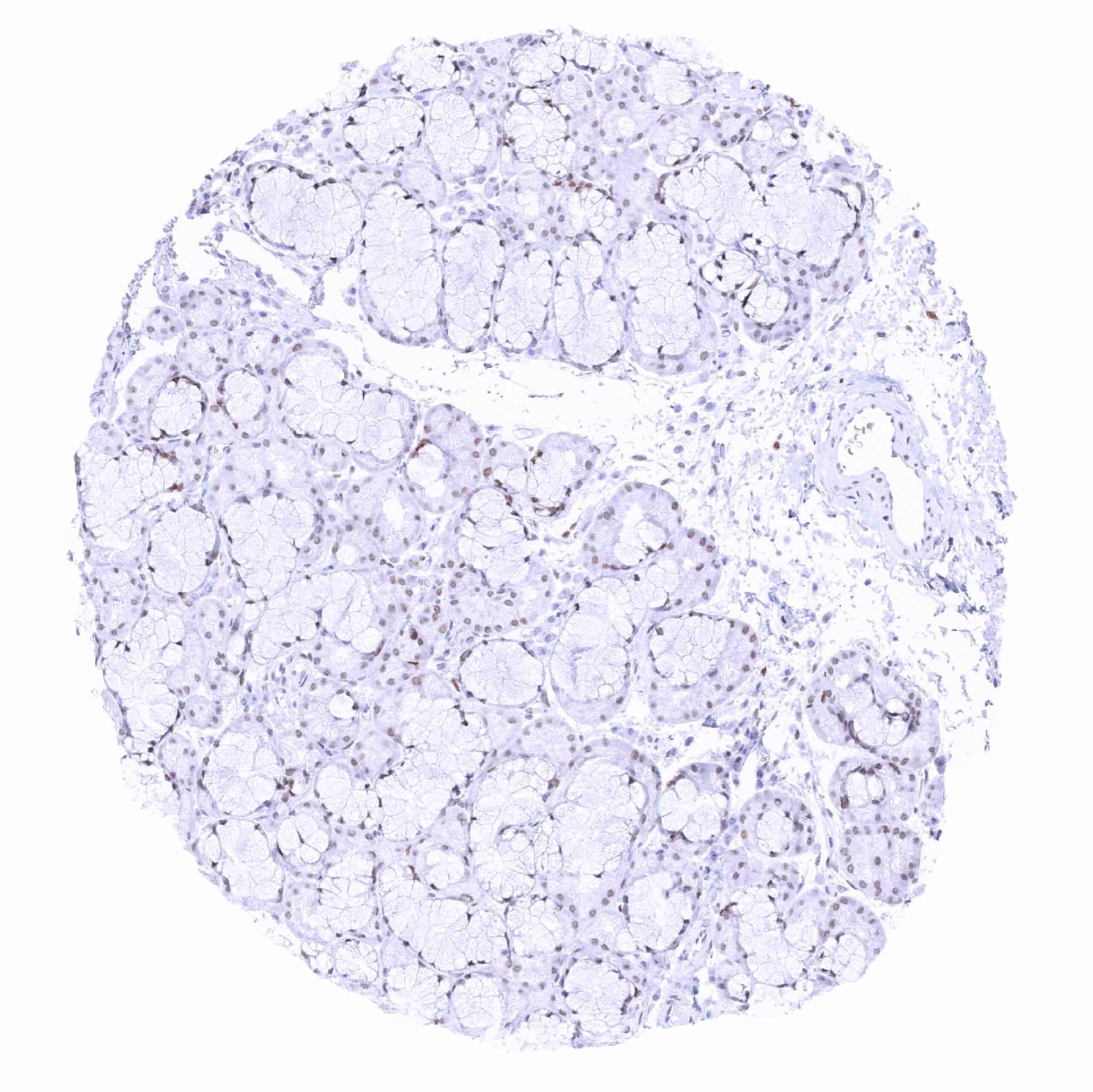 Normal Tissue Gallery TRPS1 - MS Validated Antibodies