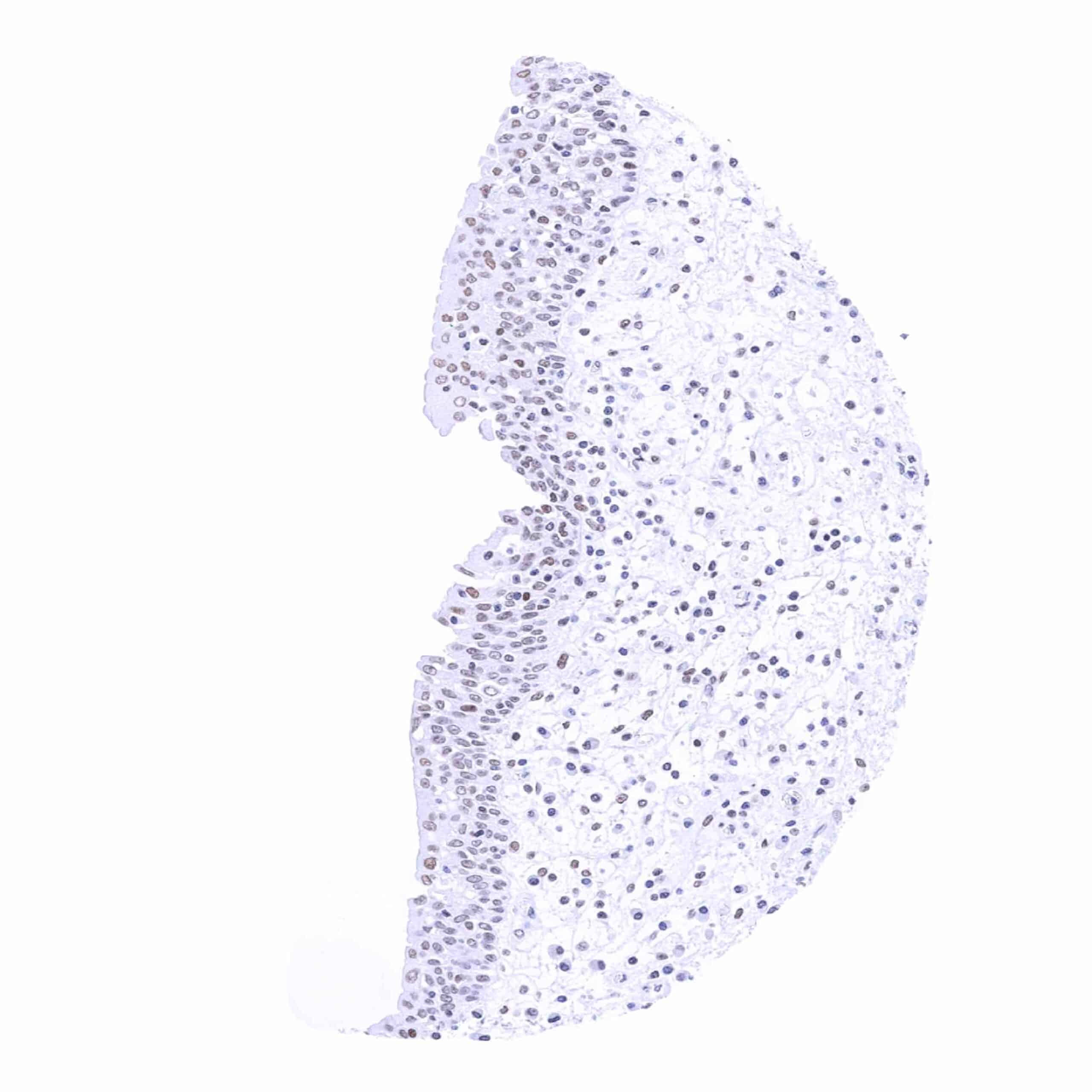 Normal Tissue Gallery TRPS1 - MS Validated Antibodies