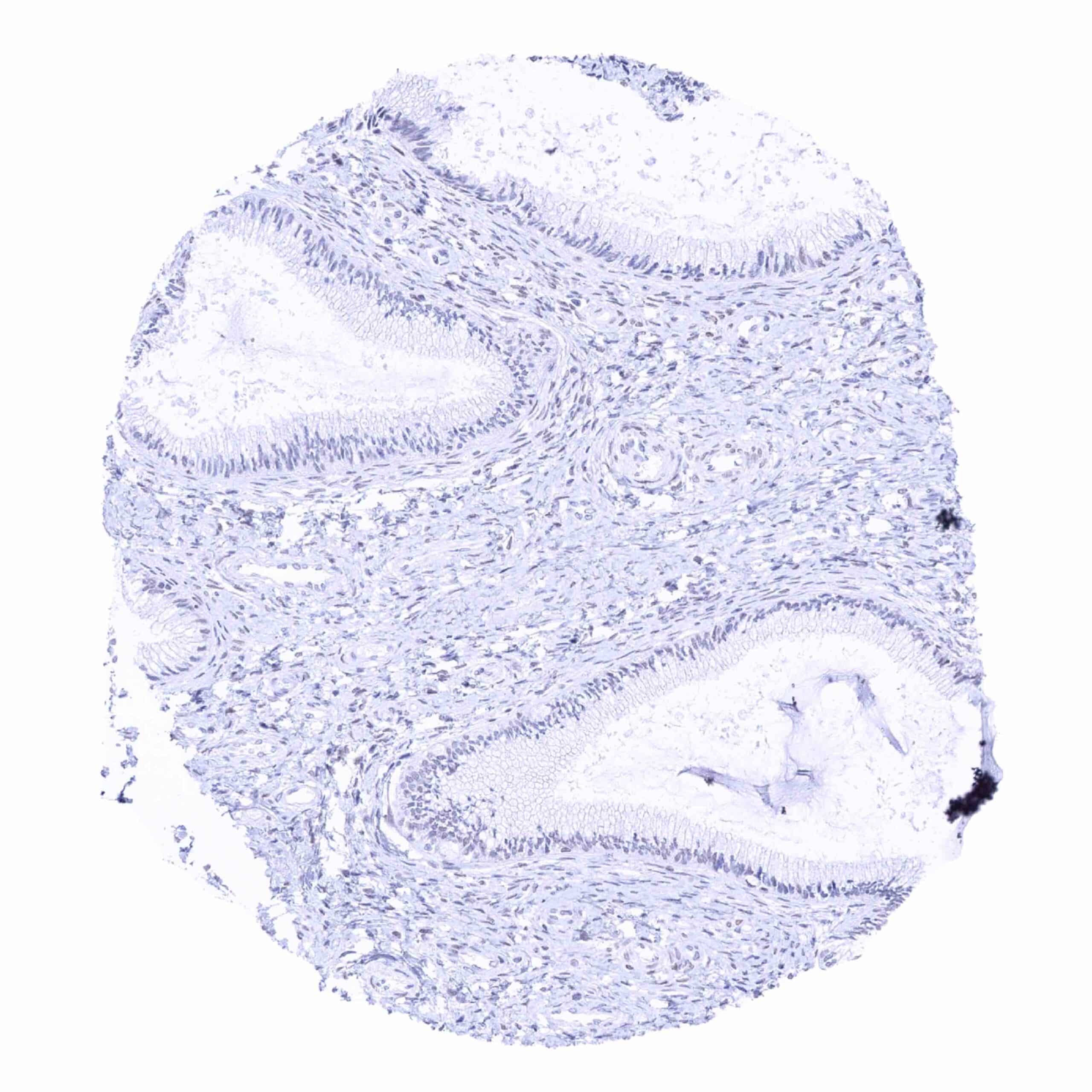 Normal Tissue Gallery TRPS1 - MS Validated Antibodies