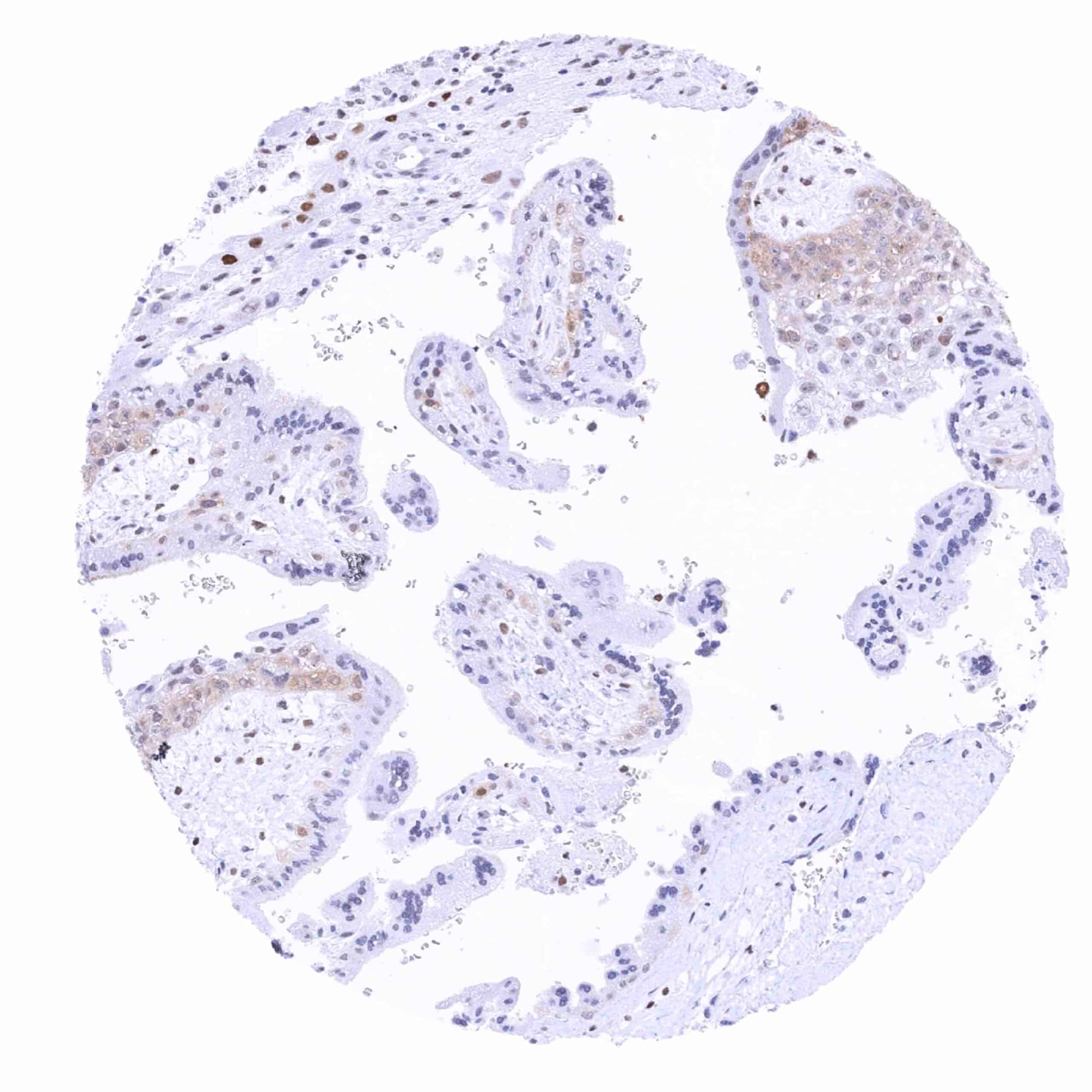 TRPS1 (MSVA-512R) - MS Validated Antibodies