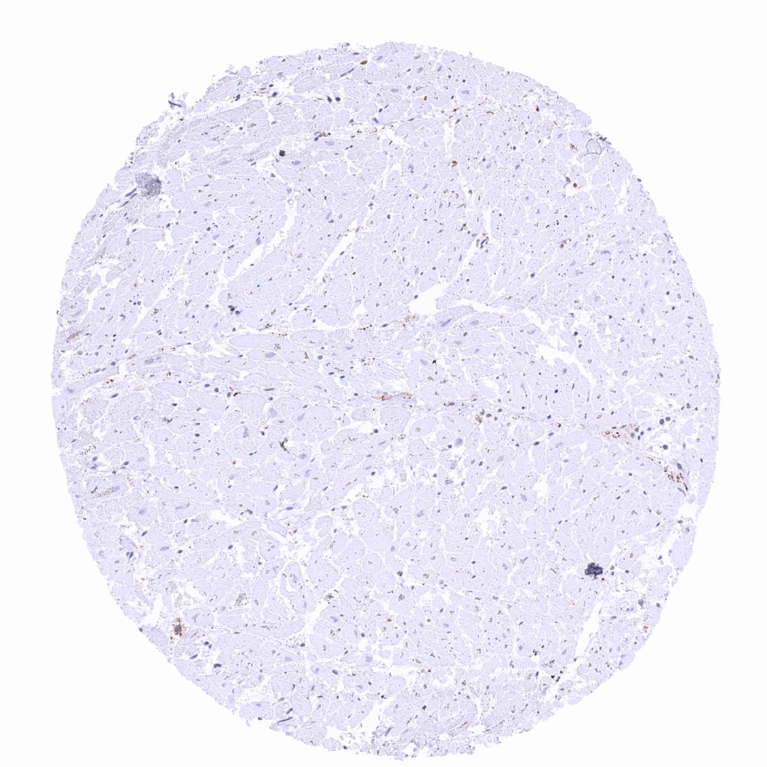 TRPS1 (MSVA-512R) - MS Validated Antibodies