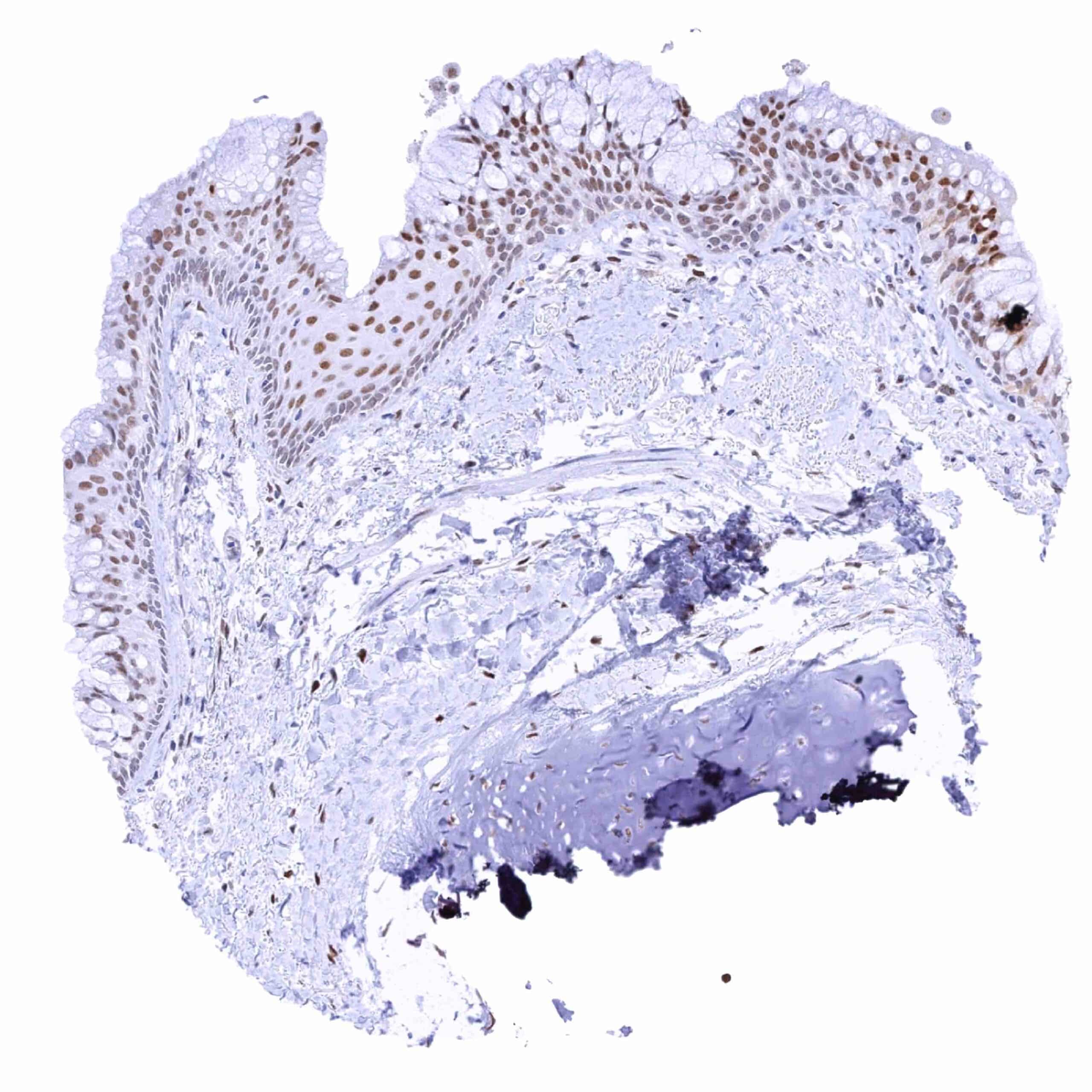 TRPS1 (MSVA-512R) - MS Validated Antibodies