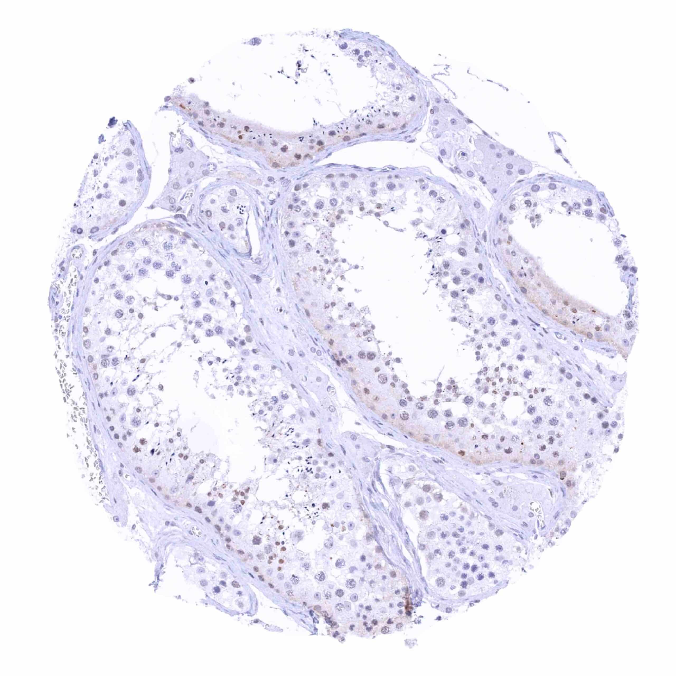 TRPS1 (MSVA-512R) - MS Validated Antibodies