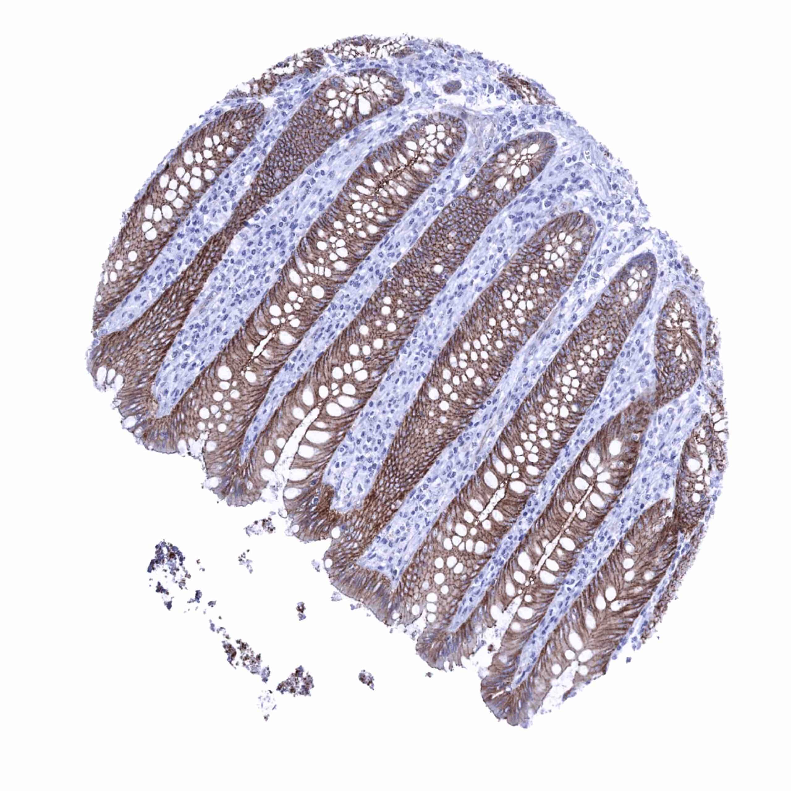 Normal Tissue Gallery Occludin - MS Validated Antibodies