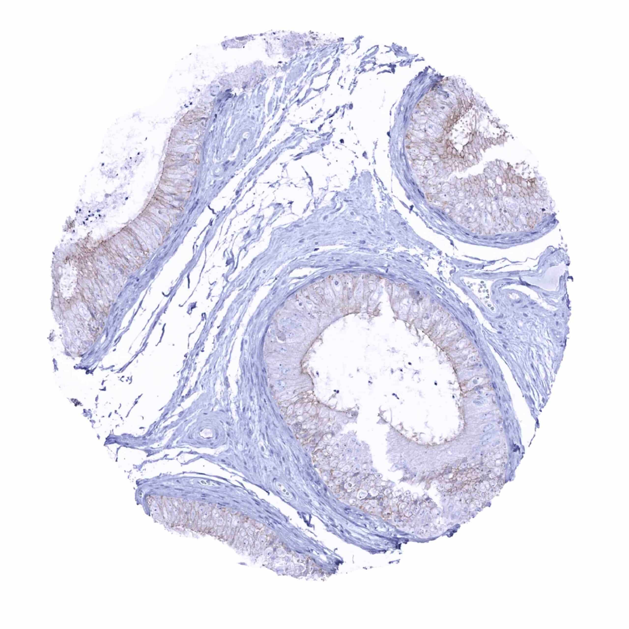 Normal Tissue Gallery Occludin - MS Validated Antibodies