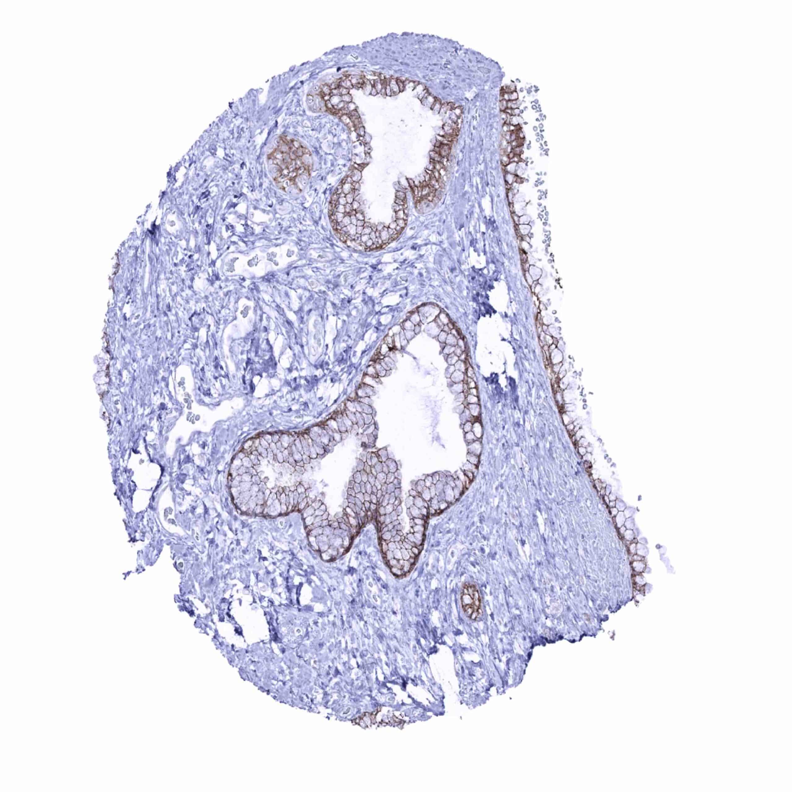 Occludin (MSVA-415M) - MS Validated Antibodies