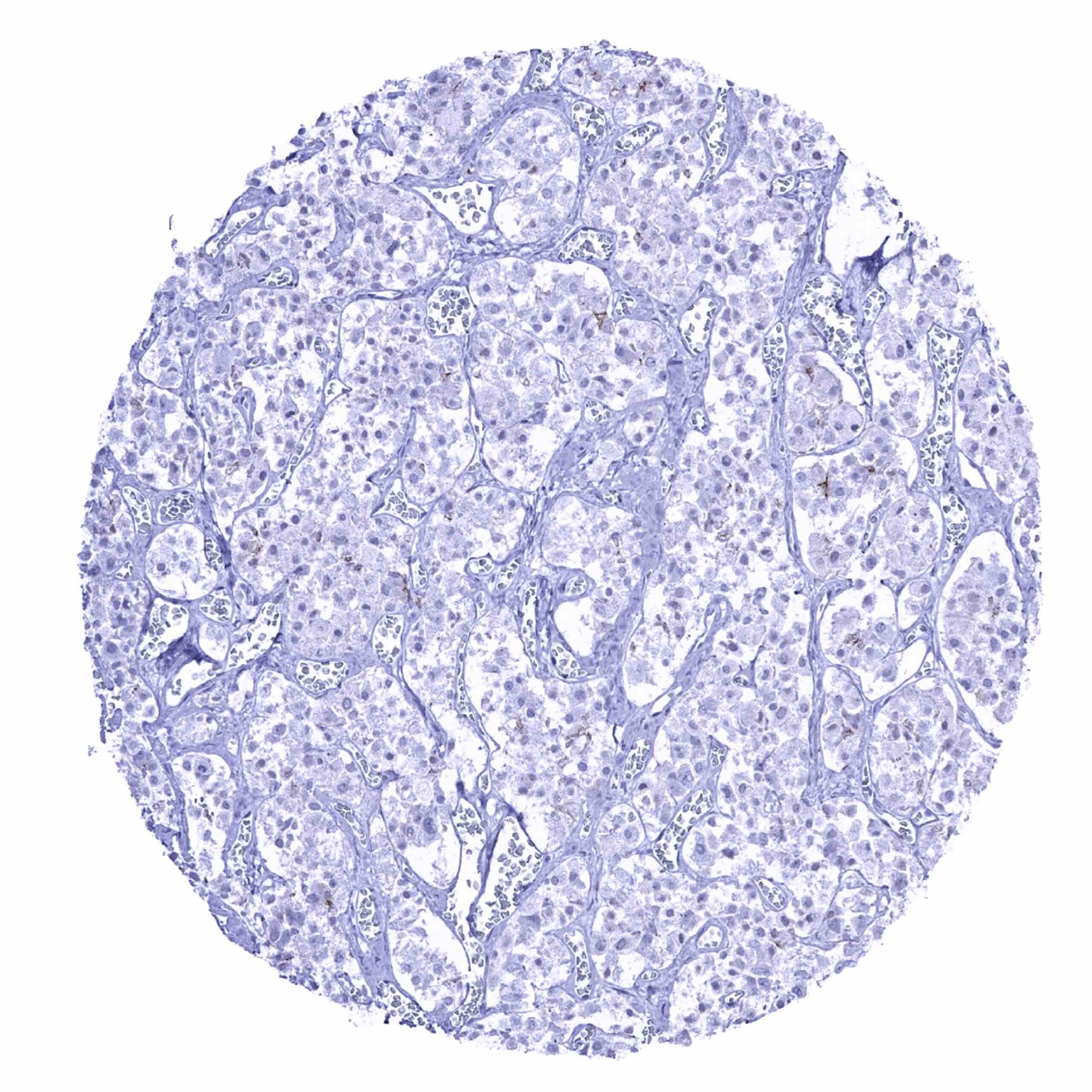 Normal Tissue Gallery Occludin - MS Validated Antibodies