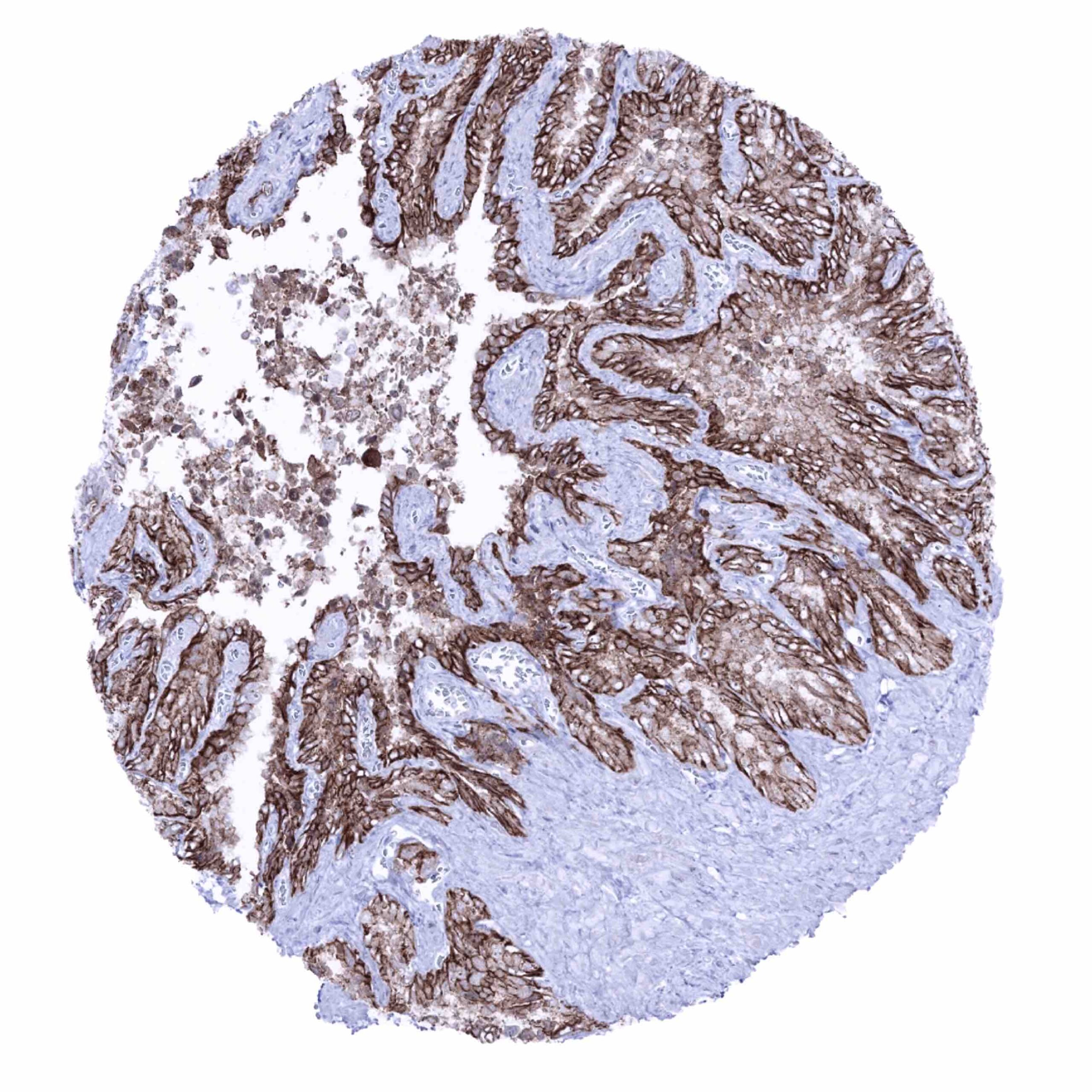 Normal Tissue Gallery Occludin - MS Validated Antibodies