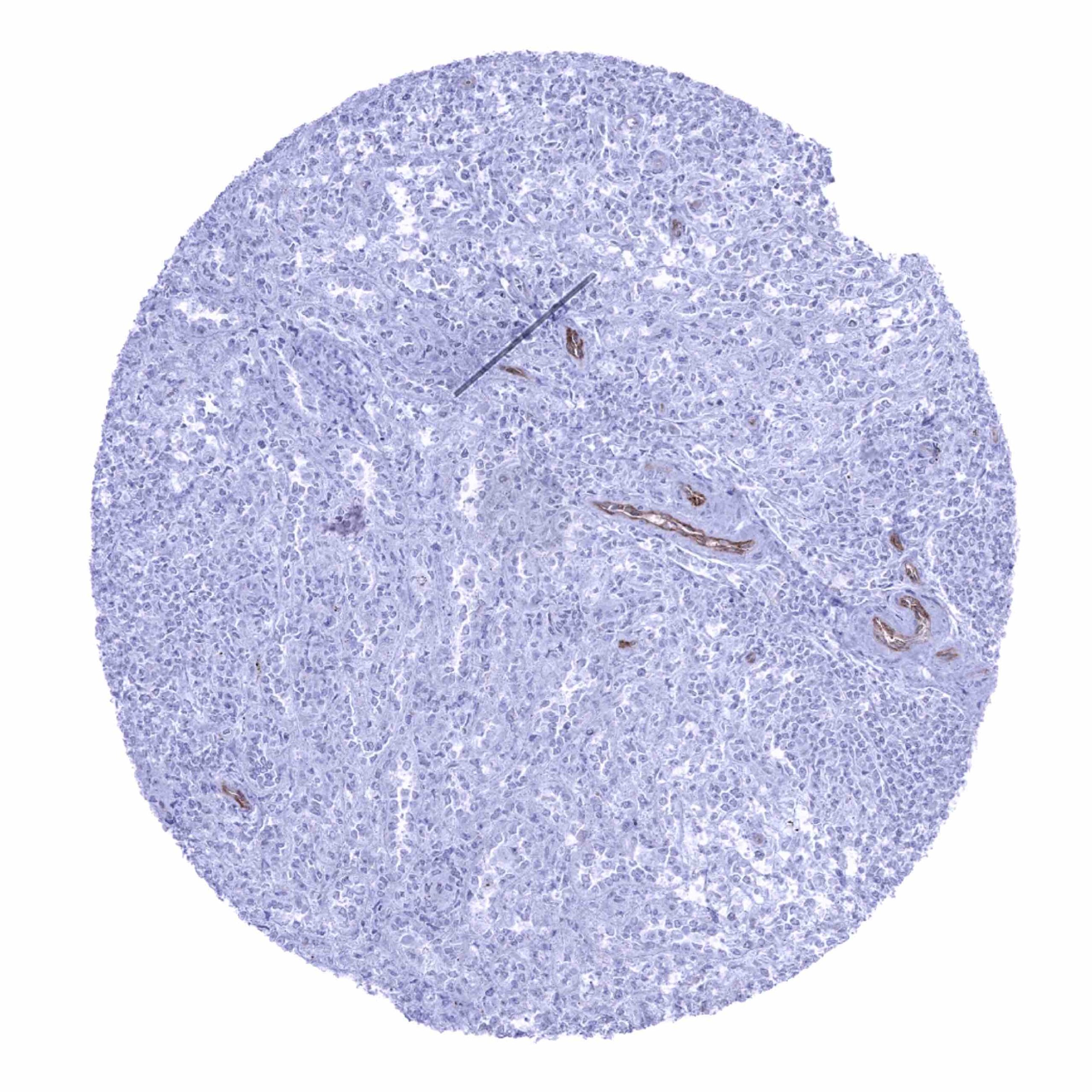 Normal Tissue Gallery Occludin - MS Validated Antibodies