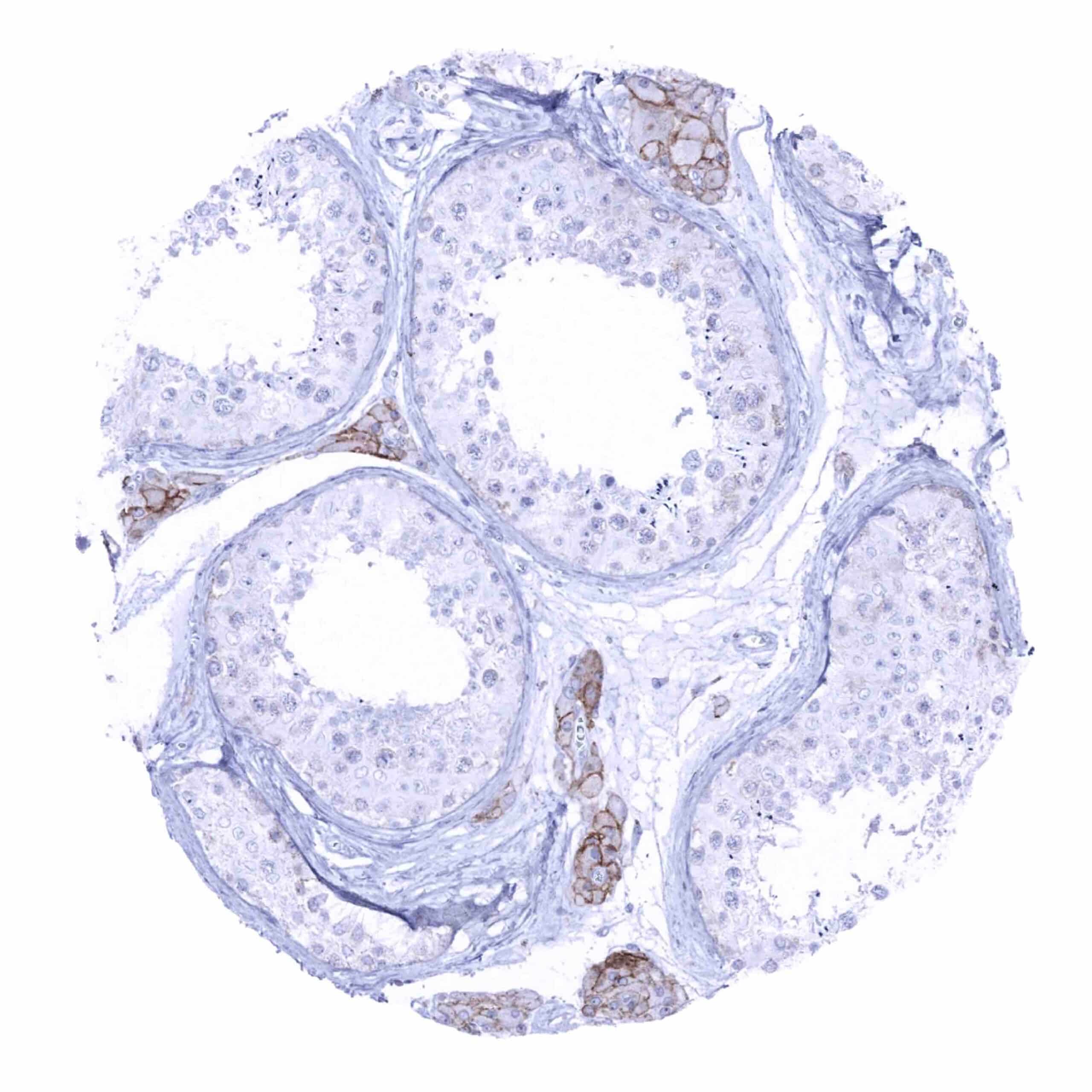 Normal Tissue Gallery Occludin - MS Validated Antibodies