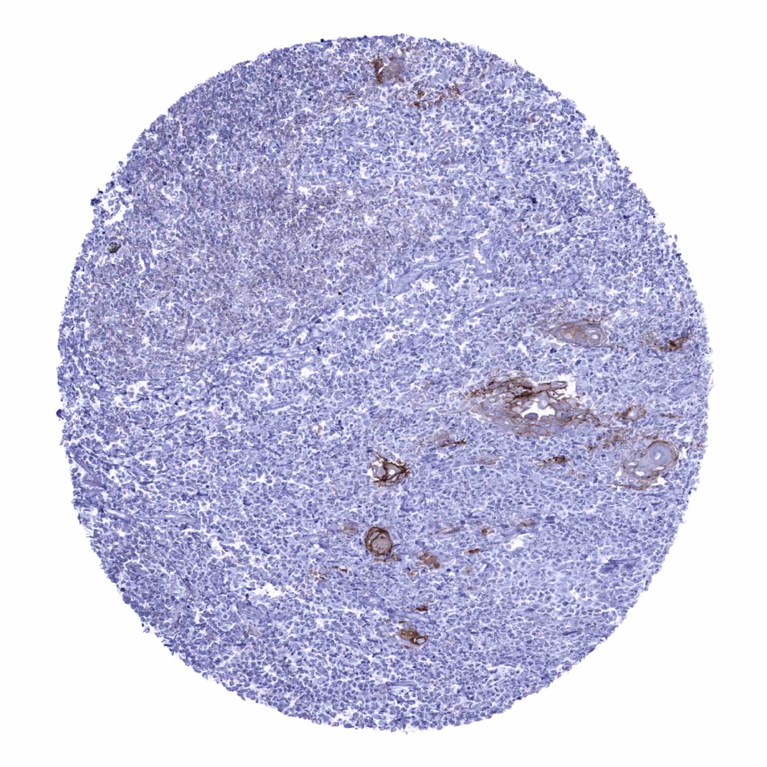 Normal Tissue Gallery Occludin - MS Validated Antibodies