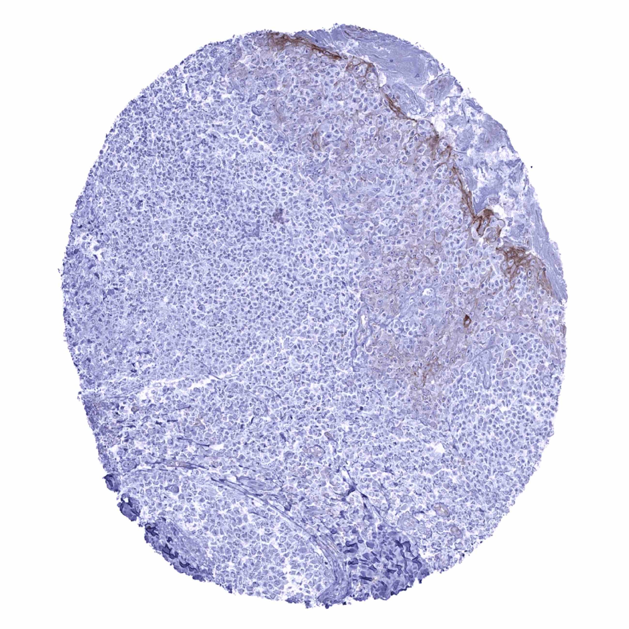 Normal Tissue Gallery Occludin - MS Validated Antibodies