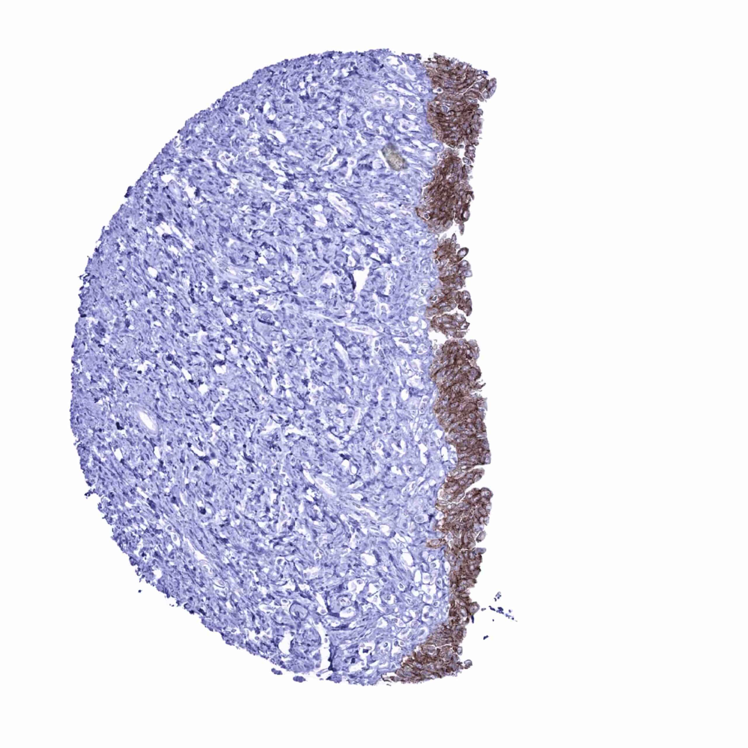 Normal Tissue Gallery Occludin - MS Validated Antibodies