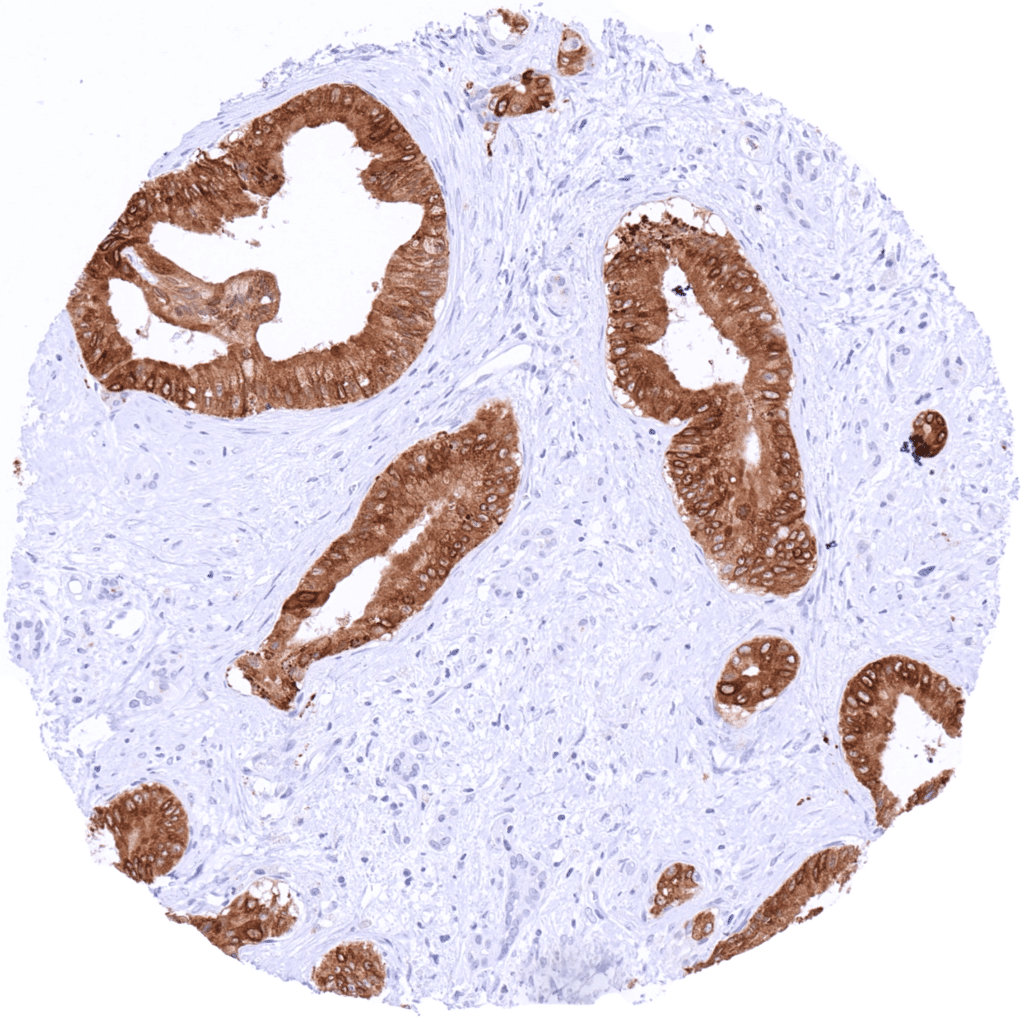 TFF1 / pS2 (MSVA-482M) - MS Validated Antibodies