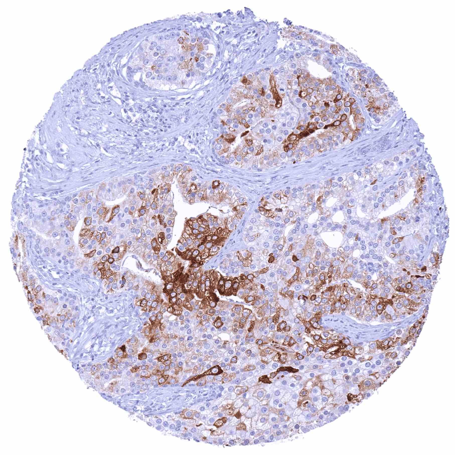 TFF1 / pS2 (MSVA-482M) - MS Validated Antibodies
