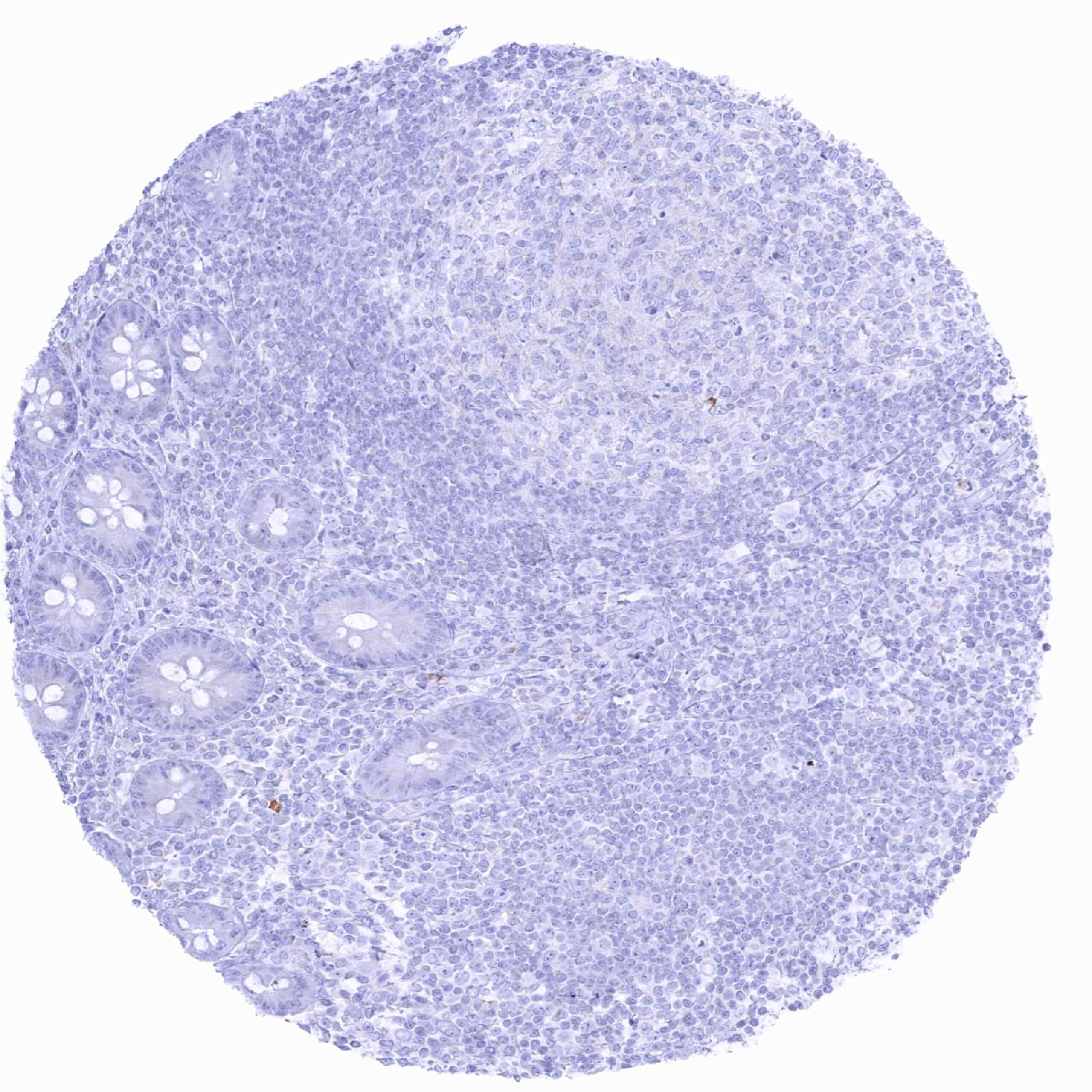 PAX8 (MSVA-708R) - MS Validated Antibodies