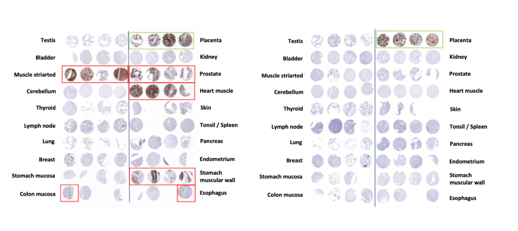 Tissue Microarrays - MS Validated Antibodies