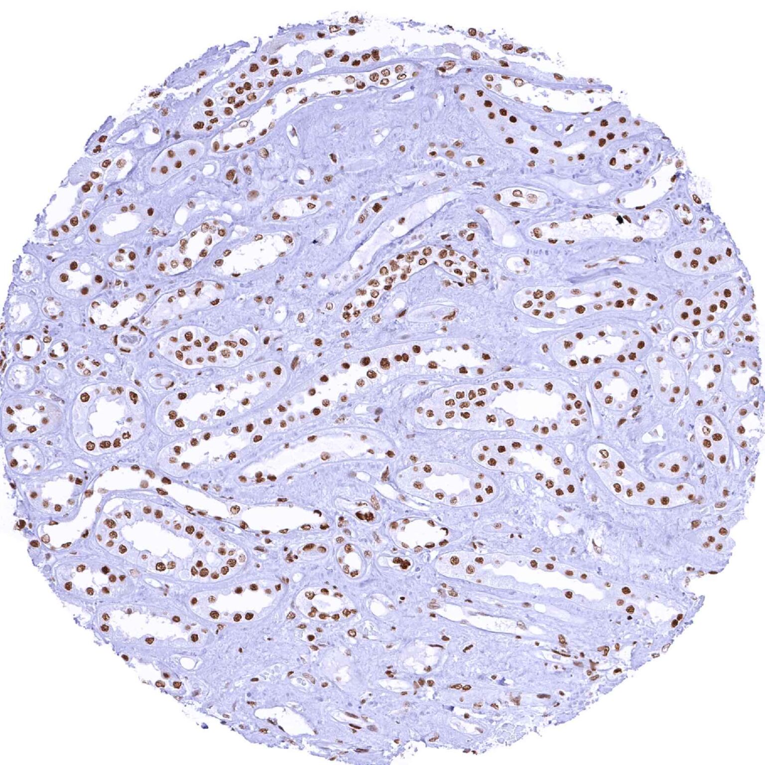 SMARCA4 / BRG1 (MSVA-397R) - MS Validated Antibodies