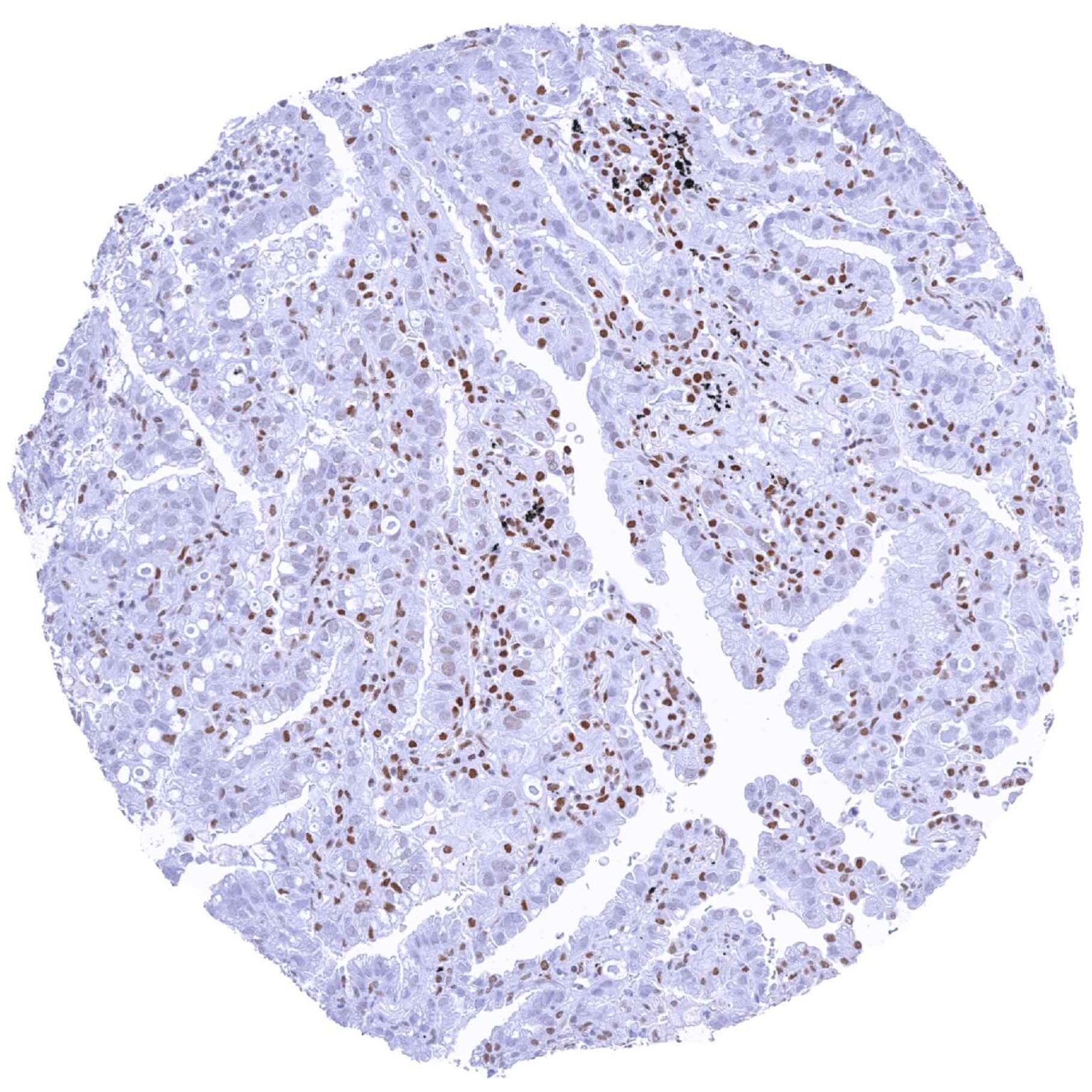 SMARCA4 / BRG1 (MSVA-397R) - MS Validated Antibodies