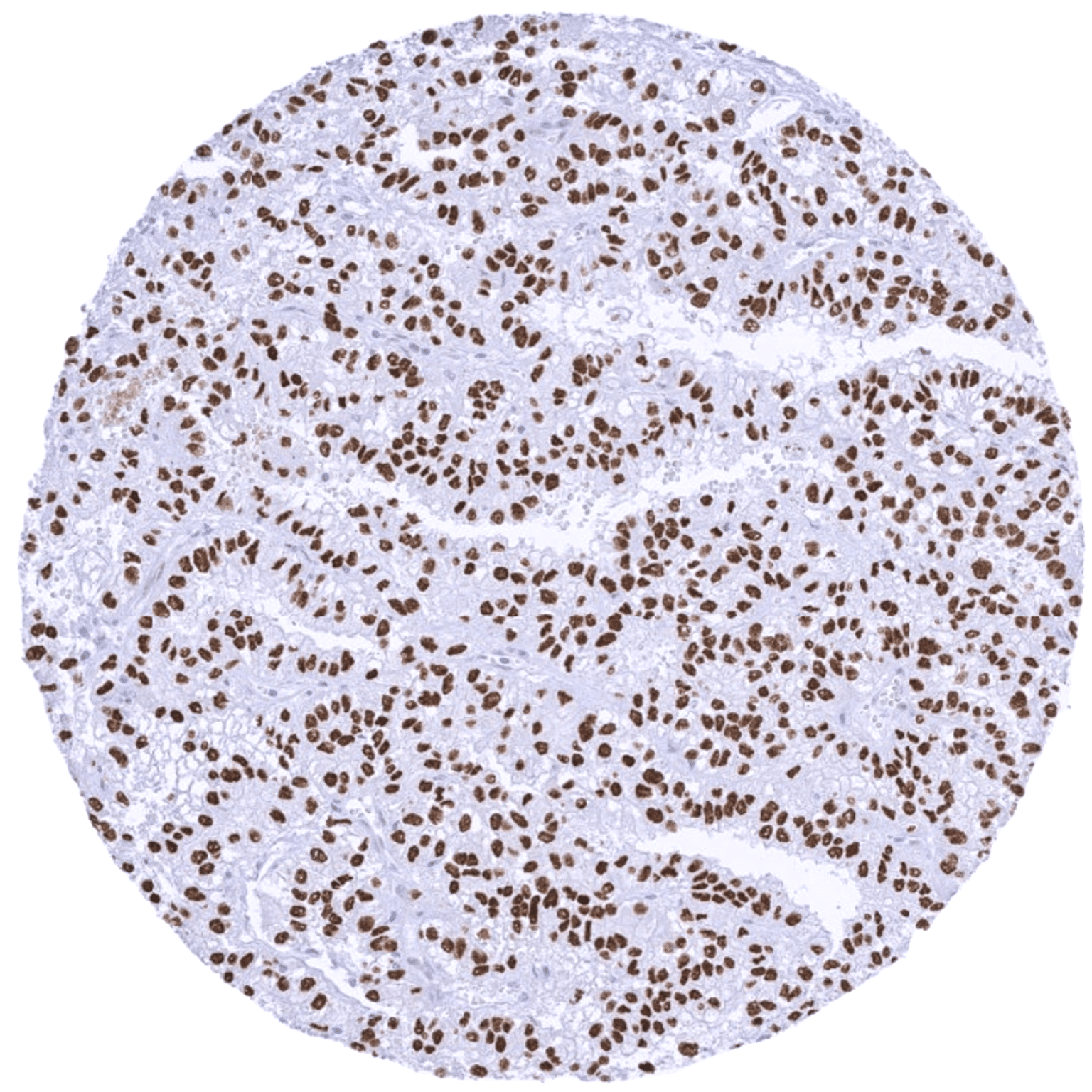 Transcription factor E3 / TFE3 (MSVA-403R) - MS Validated Antibodies