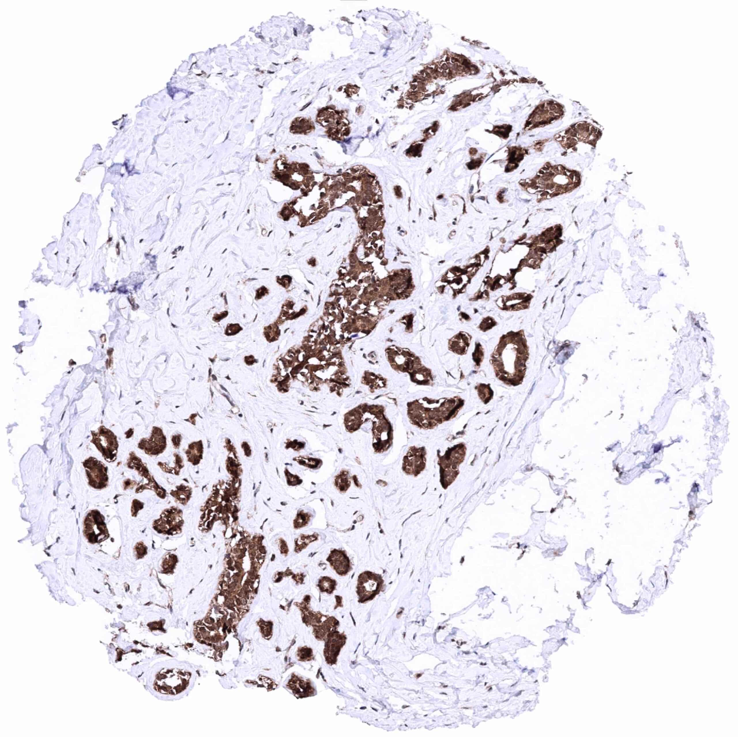 MTAP (MSVA-741R) - MS Validated Antibodies