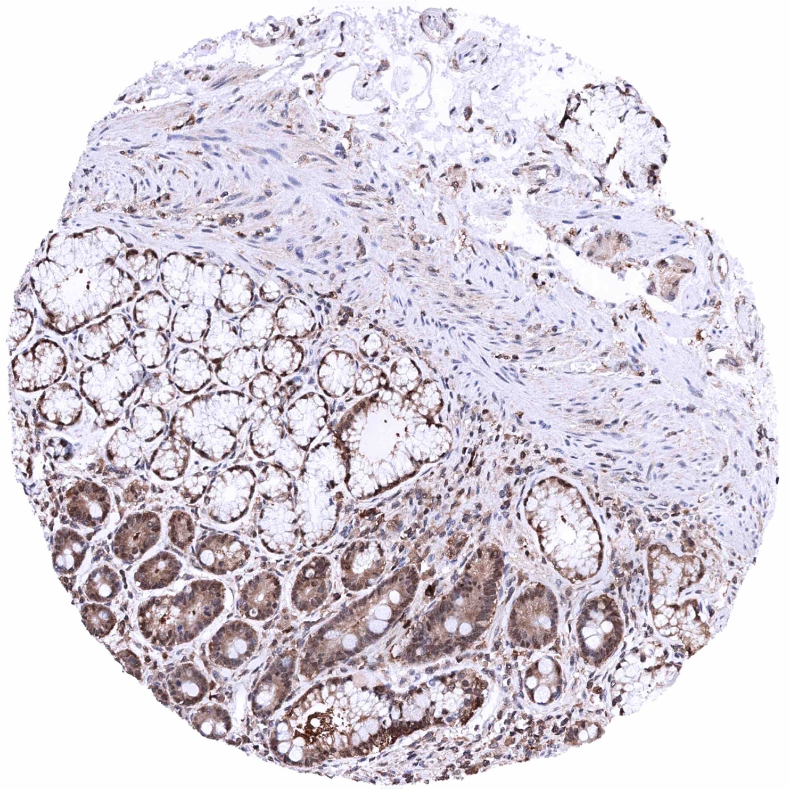MTAP (MSVA-741R) - MS Validated Antibodies
