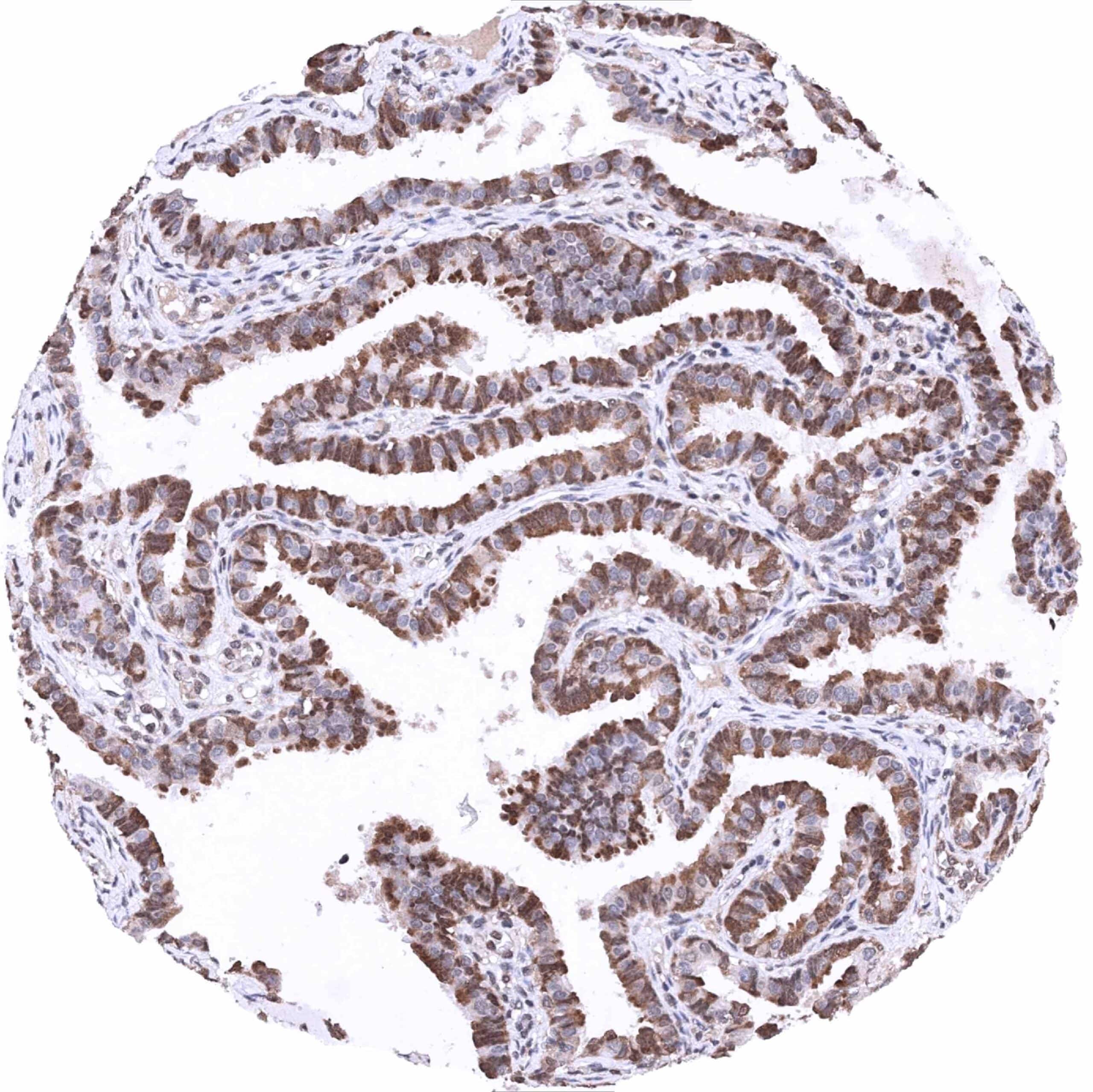 MTAP (MSVA-741R) - MS Validated Antibodies