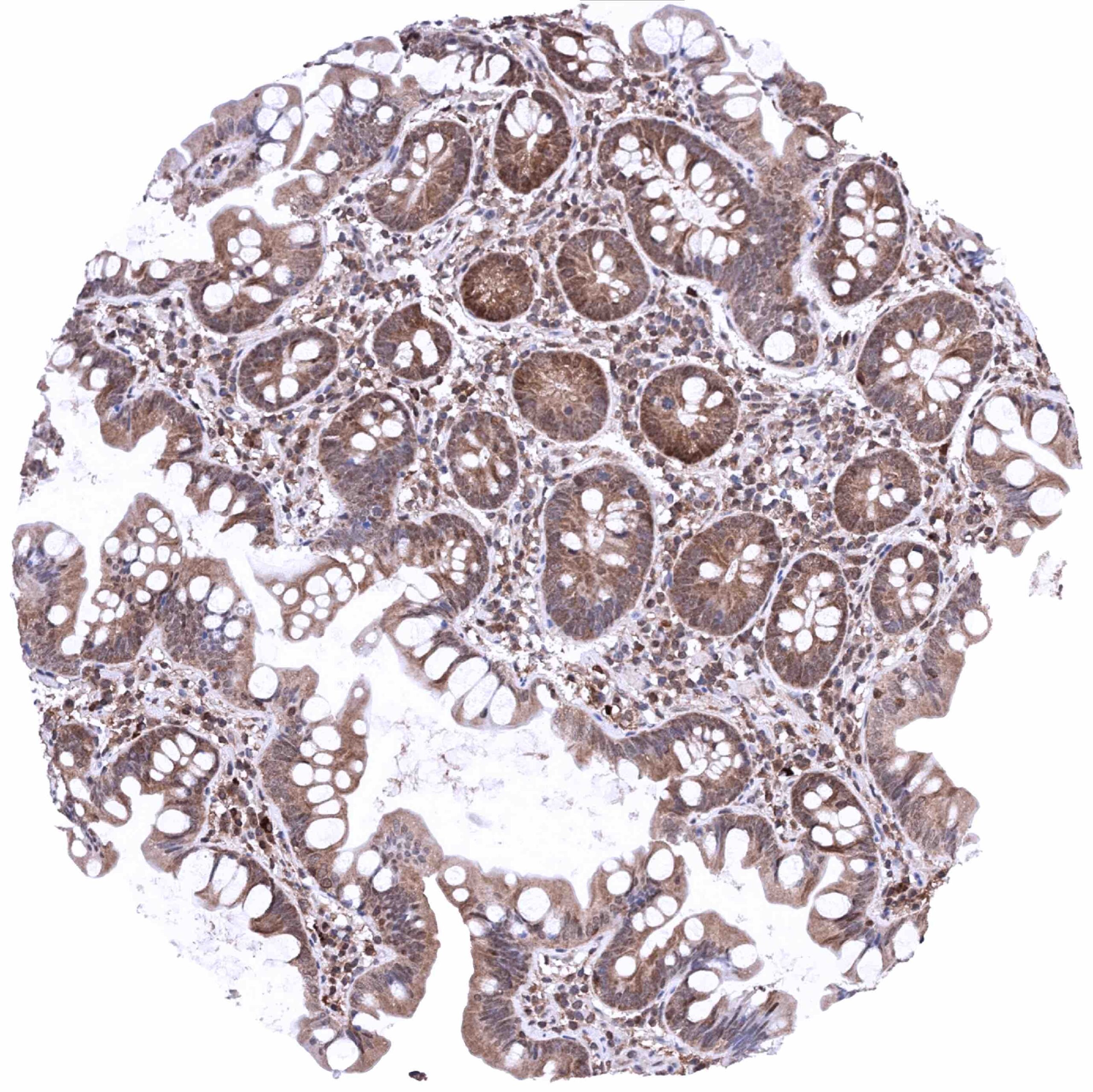 MTAP (MSVA-741R) - MS Validated Antibodies