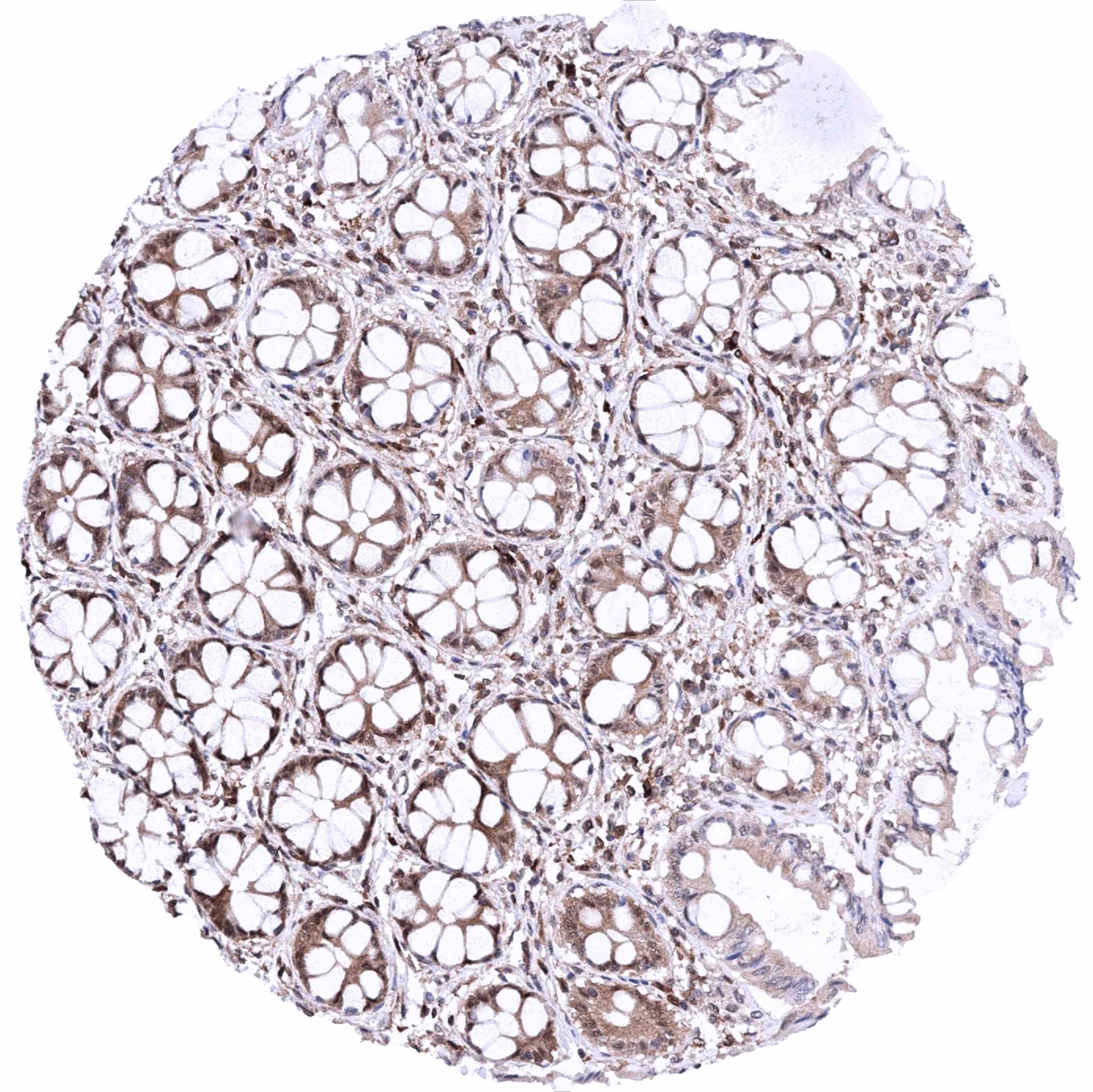 MTAP (MSVA-741R) - MS Validated Antibodies