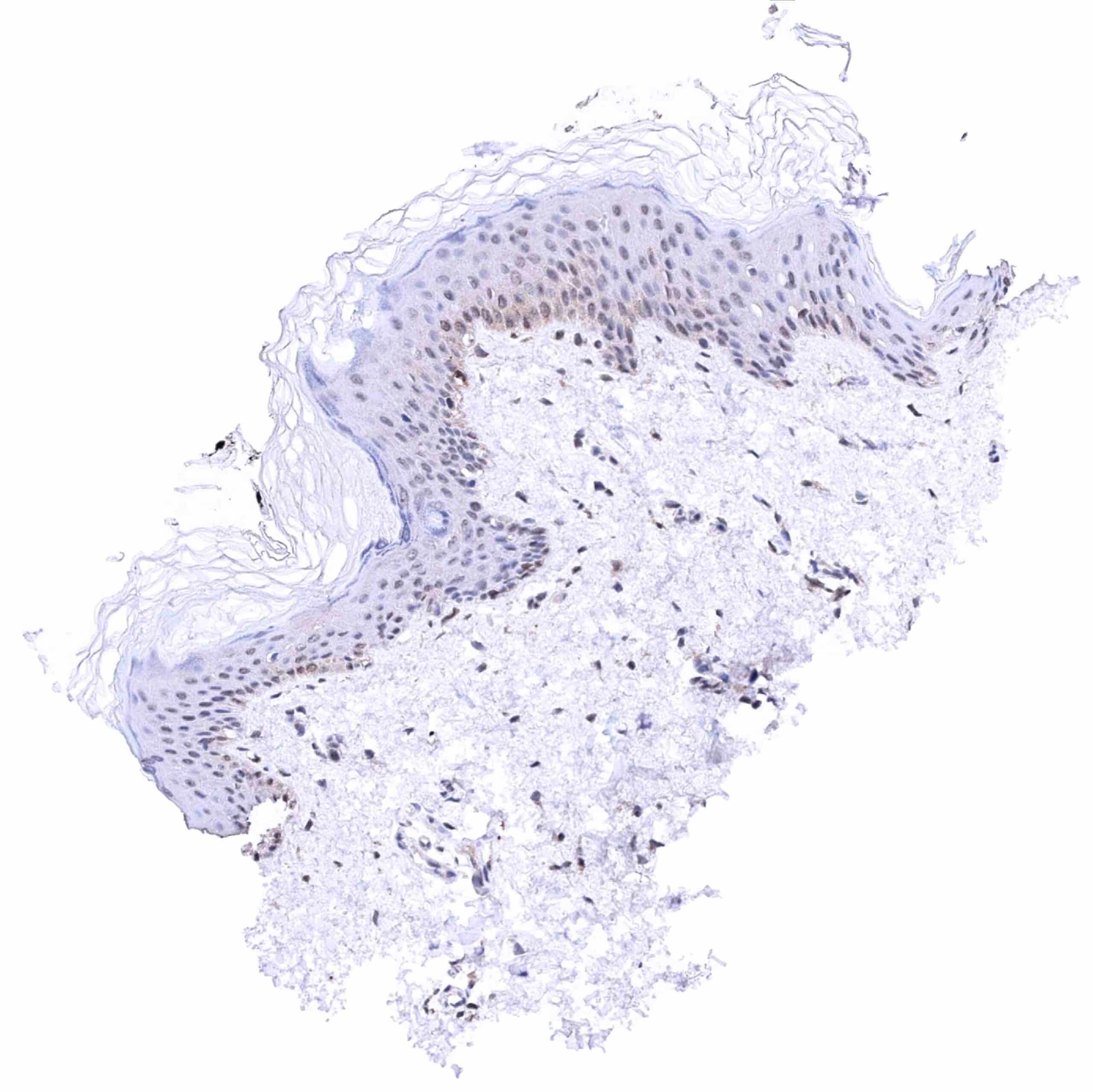 MTAP (MSVA-741R) - MS Validated Antibodies