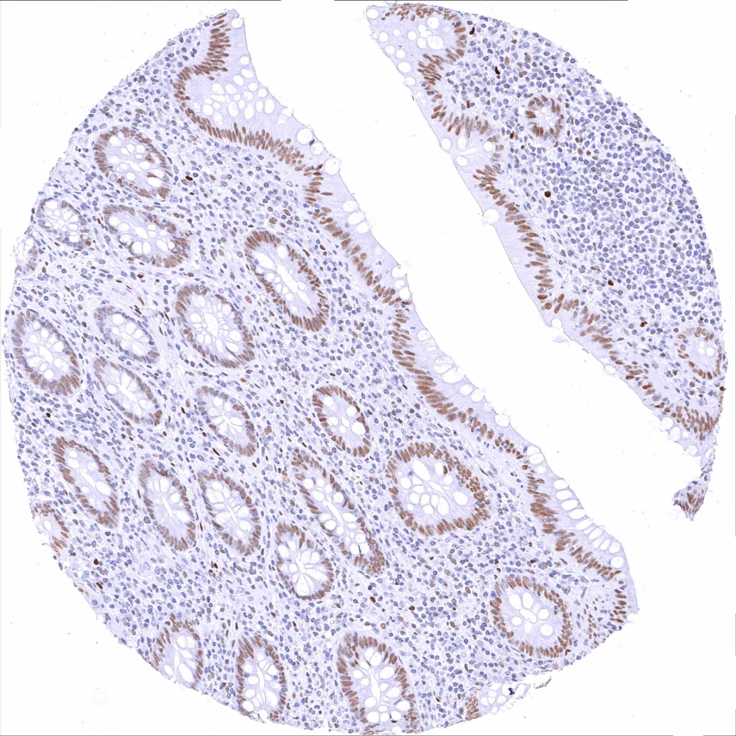 Normal Tissue Gallery TLE1 - MS Validated Antibodies