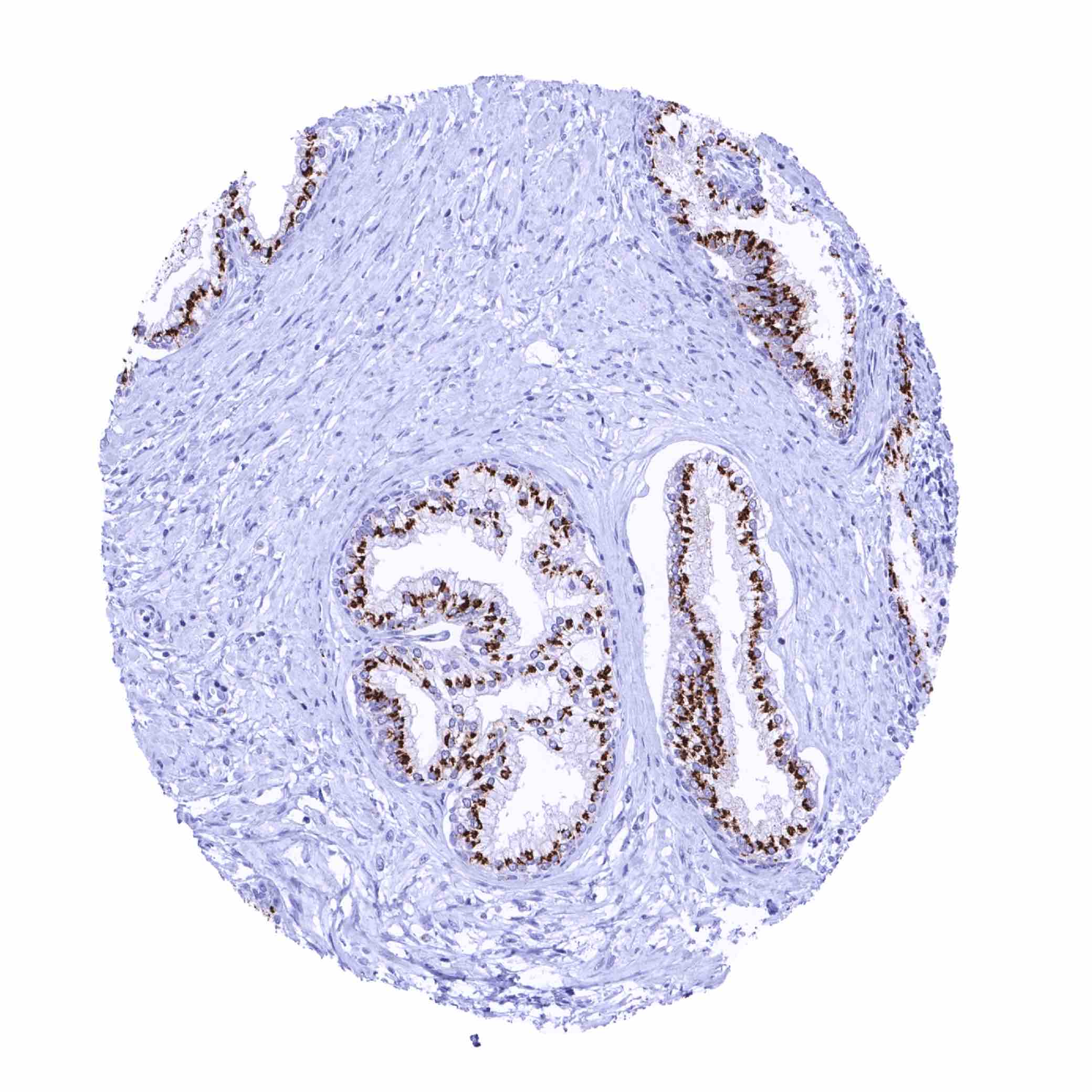 Prostein (MSVA-460R) - MS Validated Antibodies