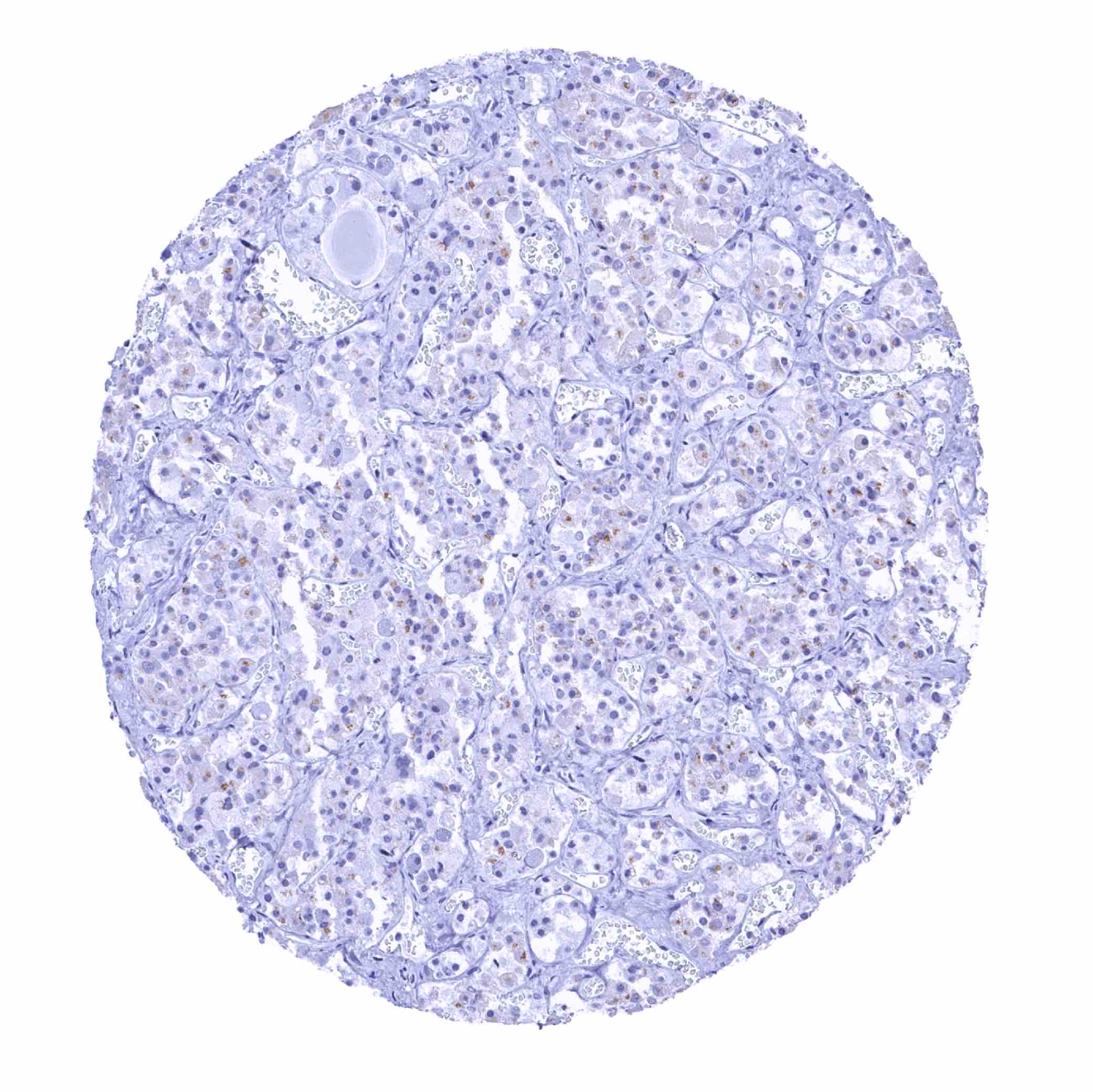 Prostein (MSVA-460R) - MS Validated Antibodies