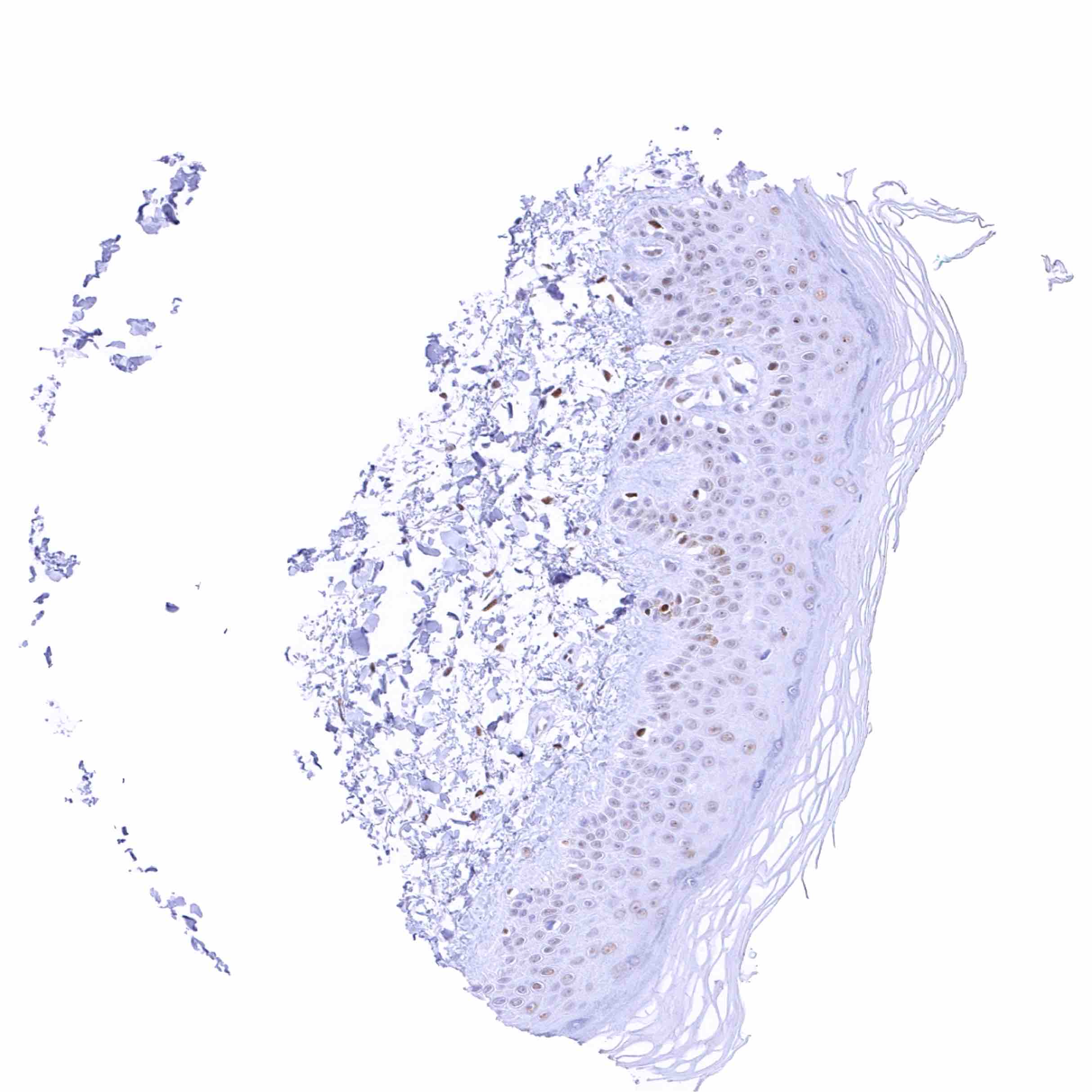 TLE1 (MSVA-856R) - MS Validated Antibodies