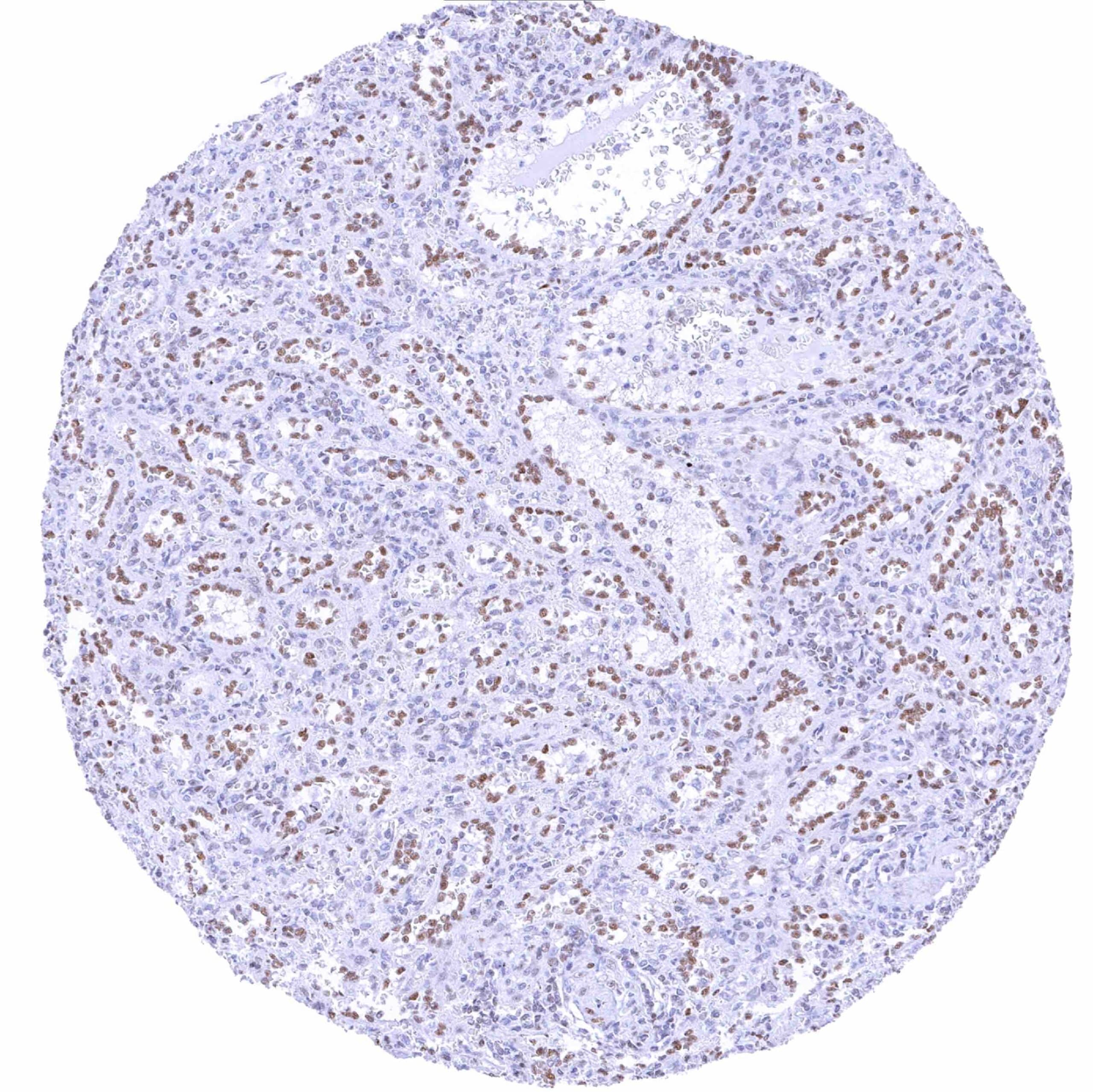 Normal Tissue Gallery TLE1 - MS Validated Antibodies