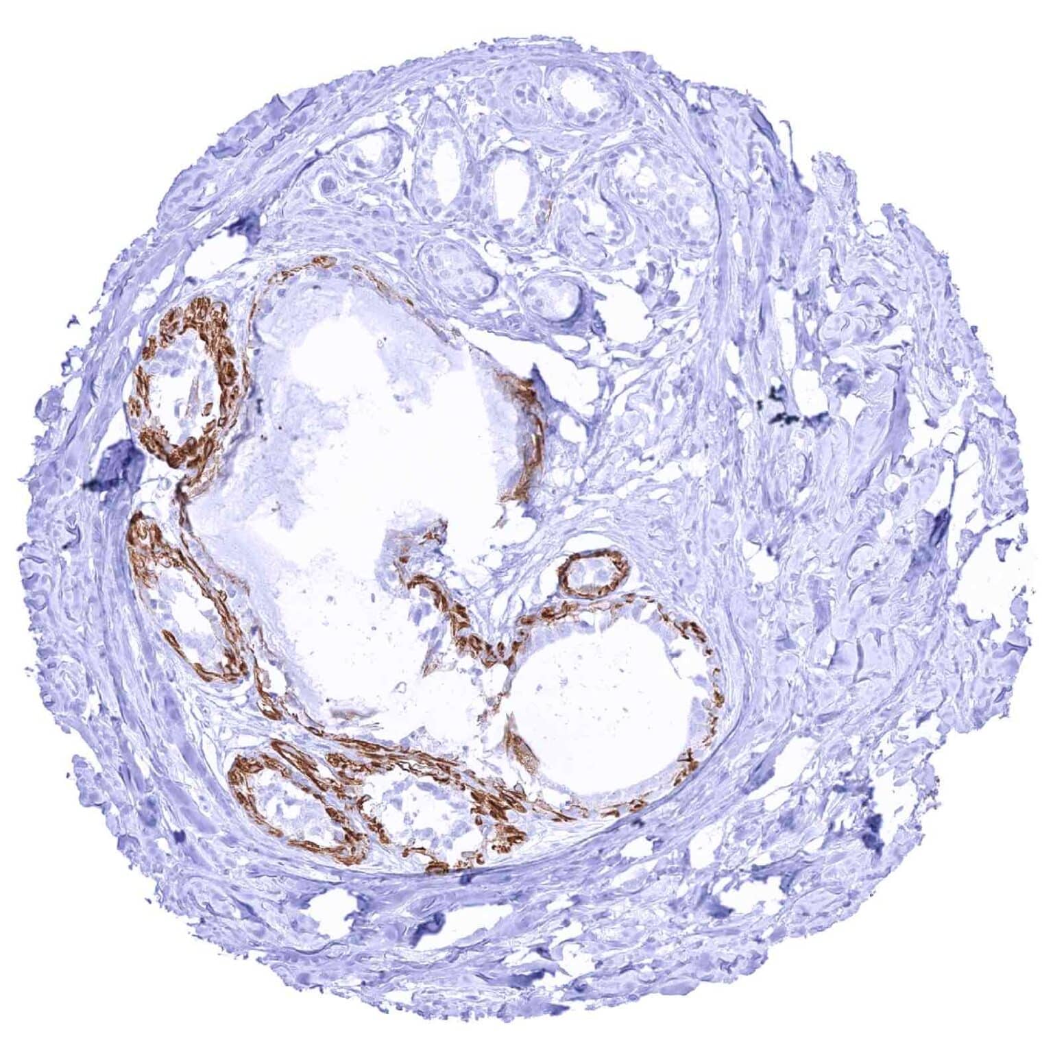 Cytokeratin 17 (MSVA-117R) - MS Validated Antibodies