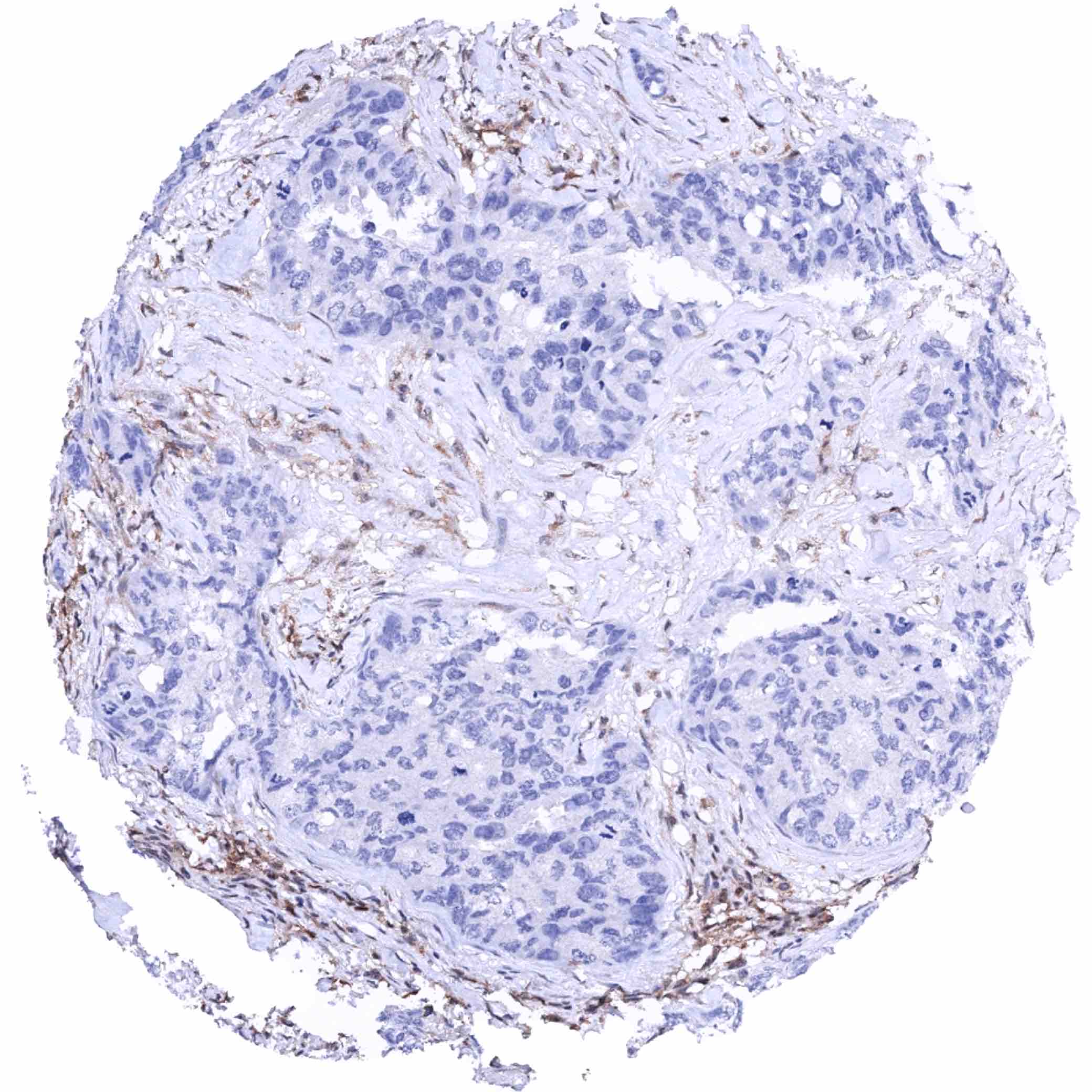 Cancer Tissue Gallery MTAP - MS Validated Antibodies