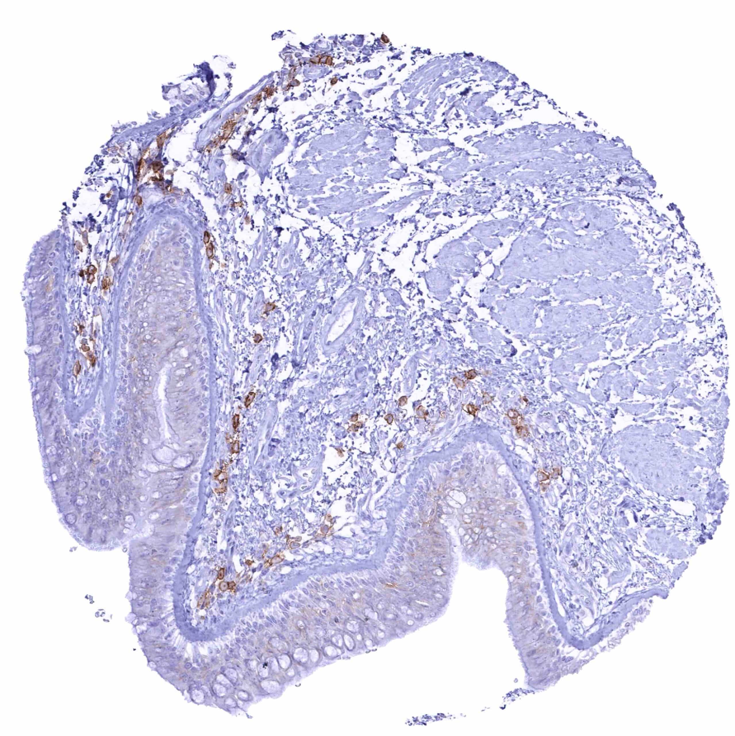 Normal Tissue Gallery CD38 - MS Validated Antibodies