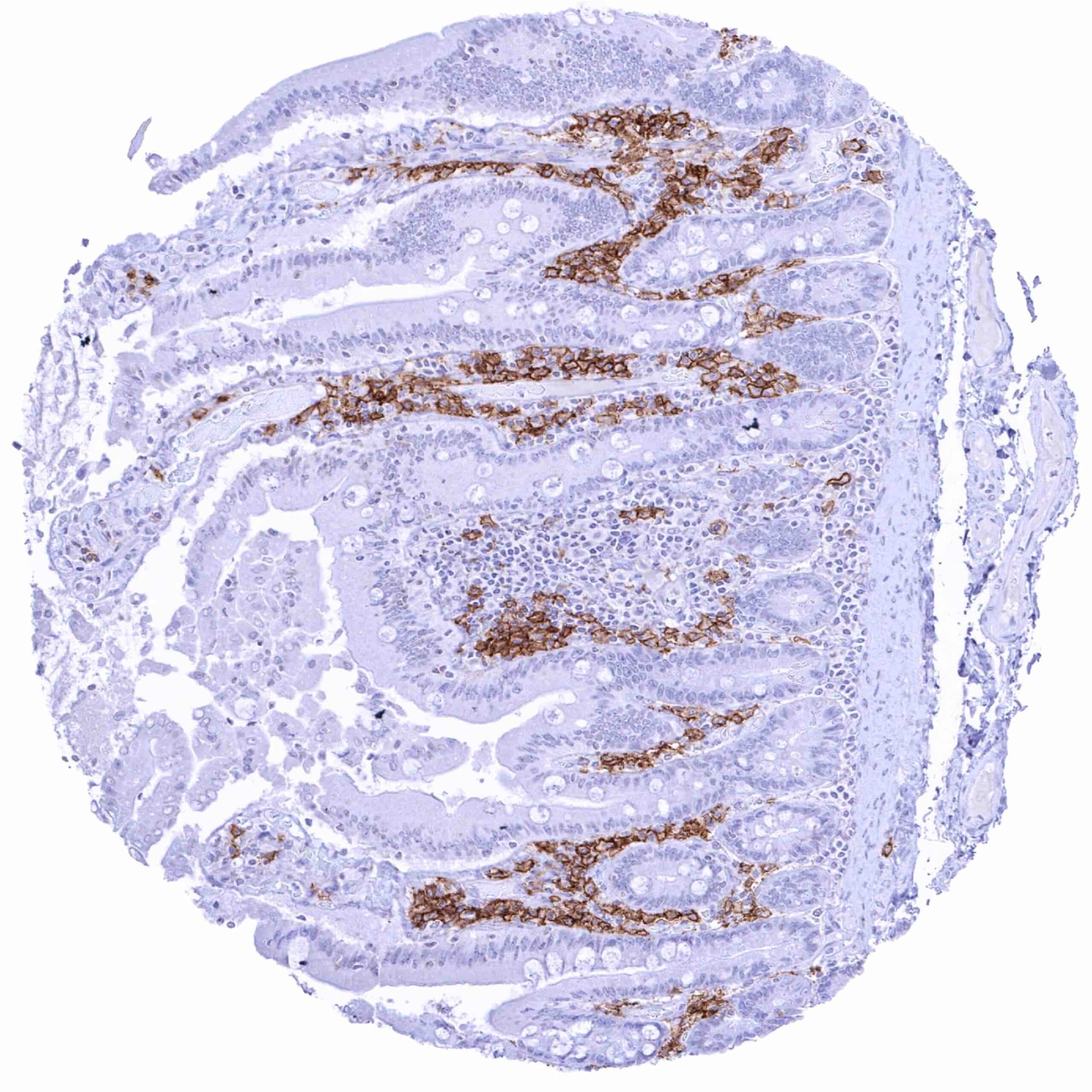 Normal Tissue Gallery CD38 - MS Validated Antibodies