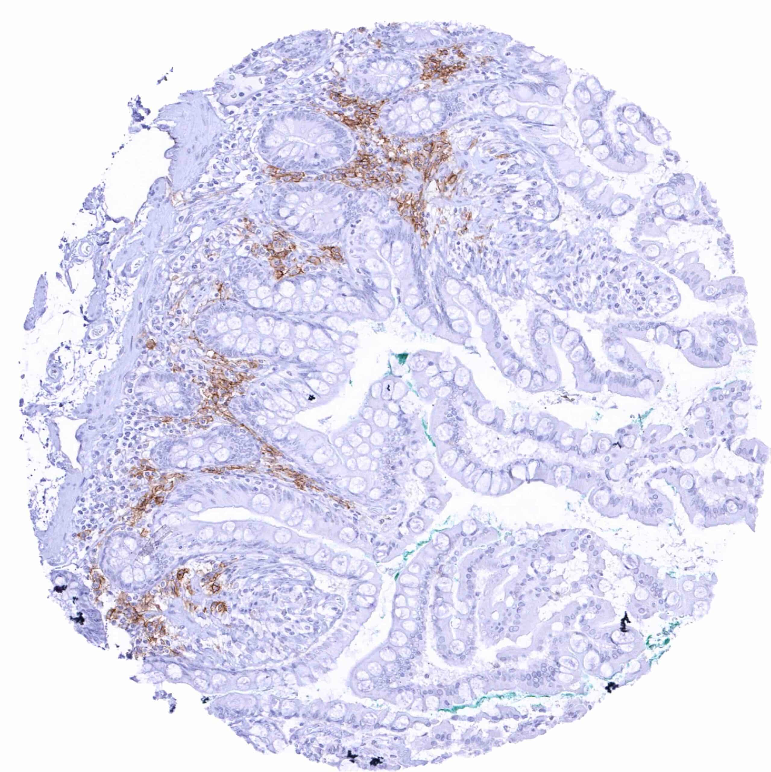 Normal Tissue Gallery CD38 - MS Validated Antibodies