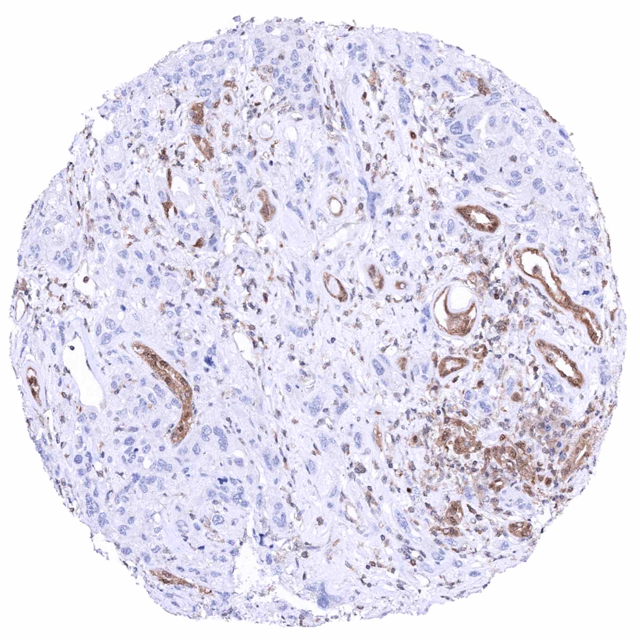 Cancer Tissue Gallery MTAP - MS Validated Antibodies