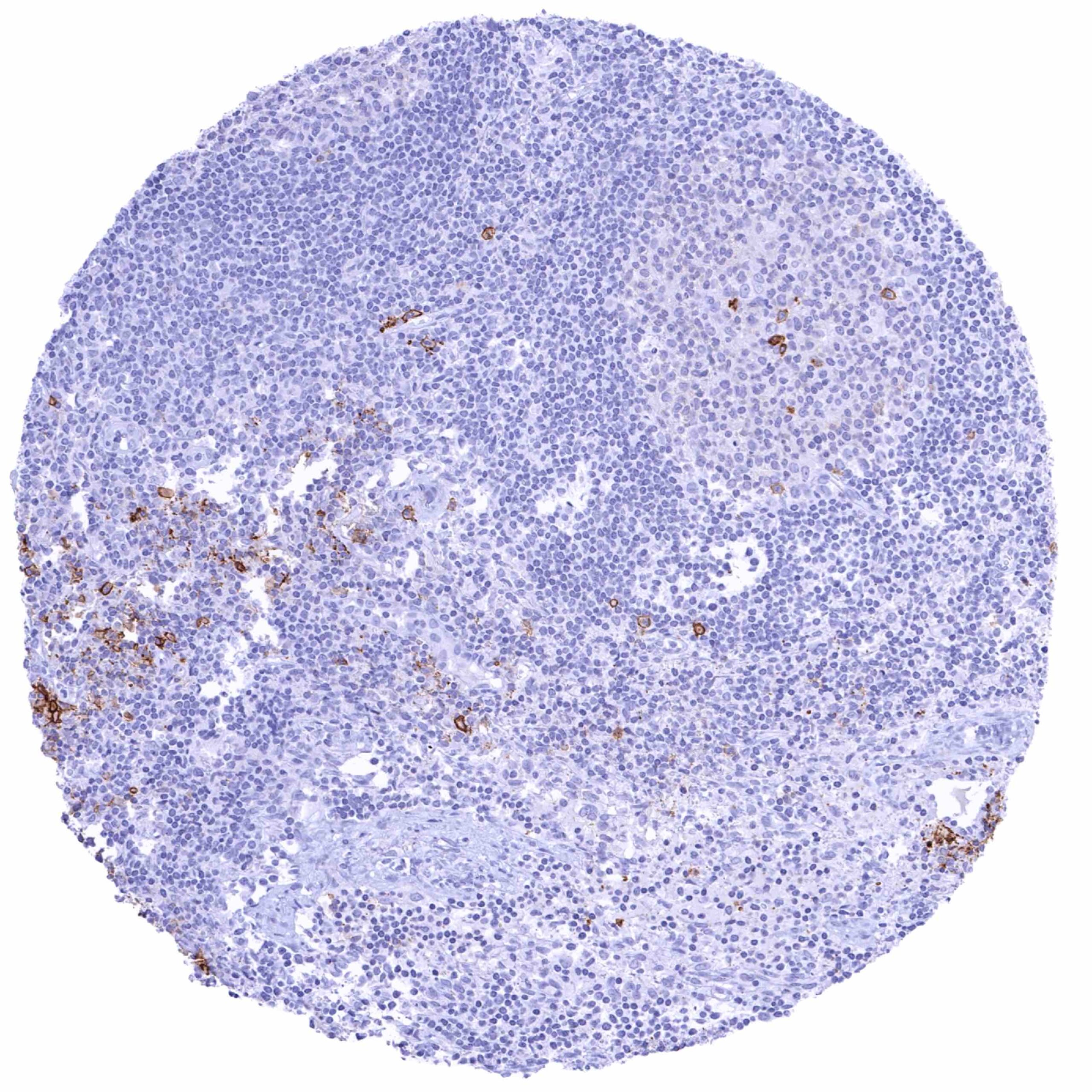 Normal Tissue Gallery CD38 - MS Validated Antibodies