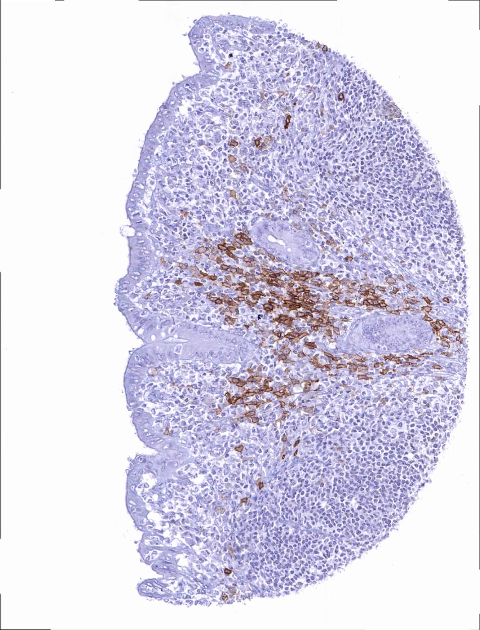 CD38 (MSVA-038R) - MS Validated Antibodies