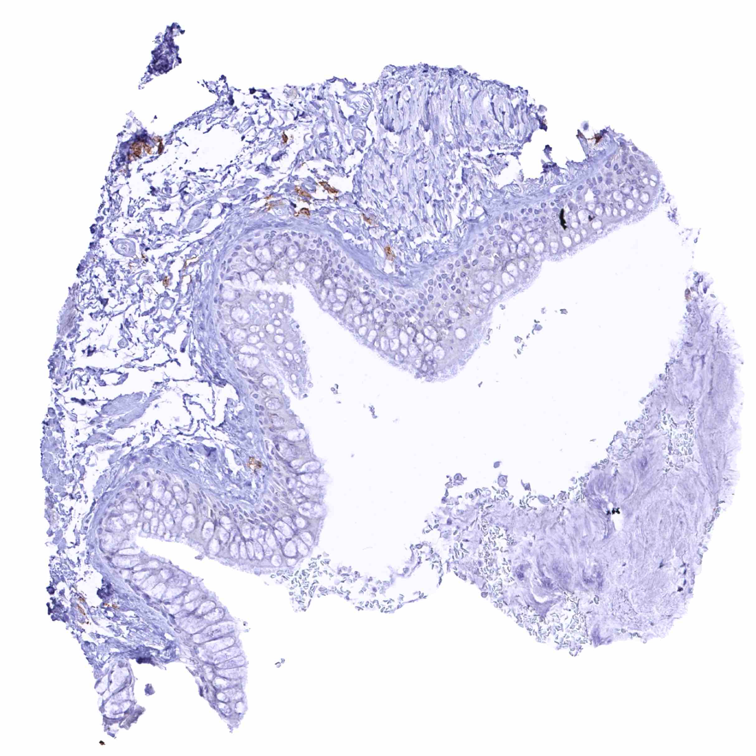 CD38 (MSVA-038R) - MS Validated Antibodies