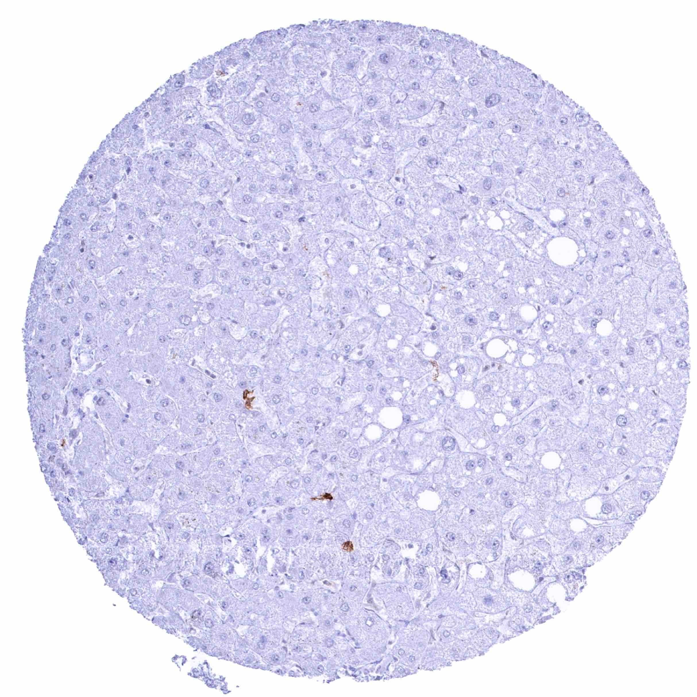 CD38 (MSVA-038R) - MS Validated Antibodies